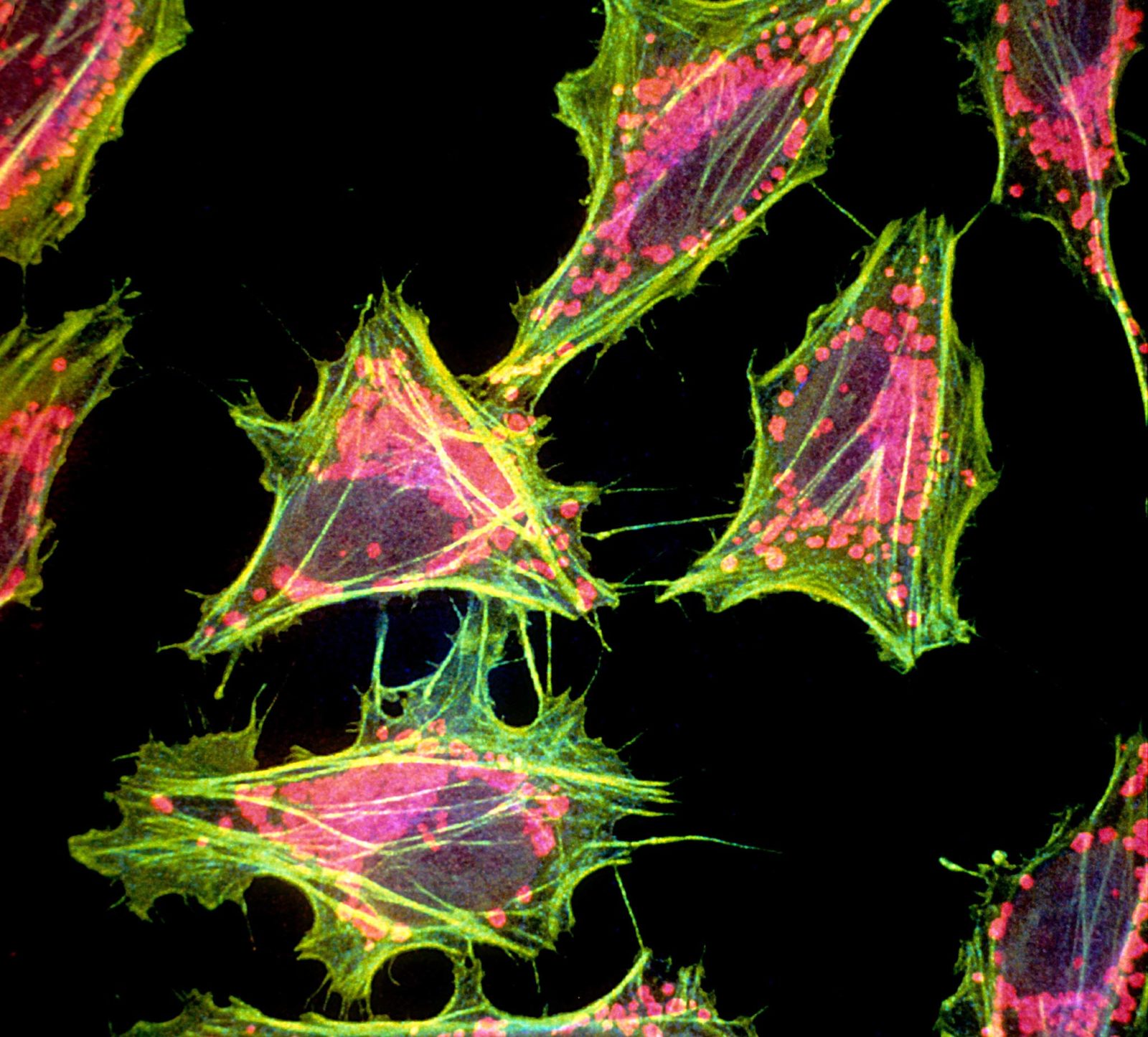 HeLa (cancer) cells in culture | Nikon Small World