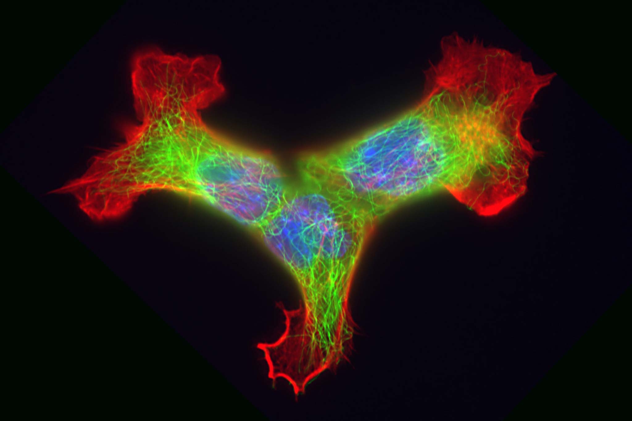 Human epithelial cells, triple stained | Nikon Small World