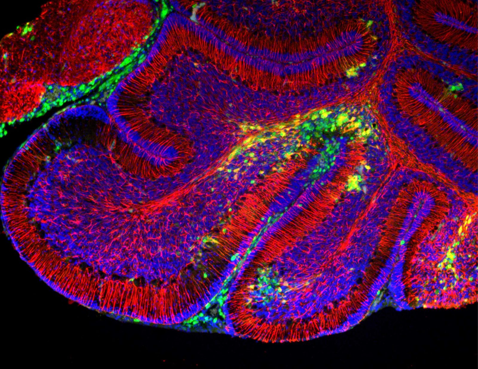 Sagittal section of mouse cerebellum, infected with cytomegalovirus ...