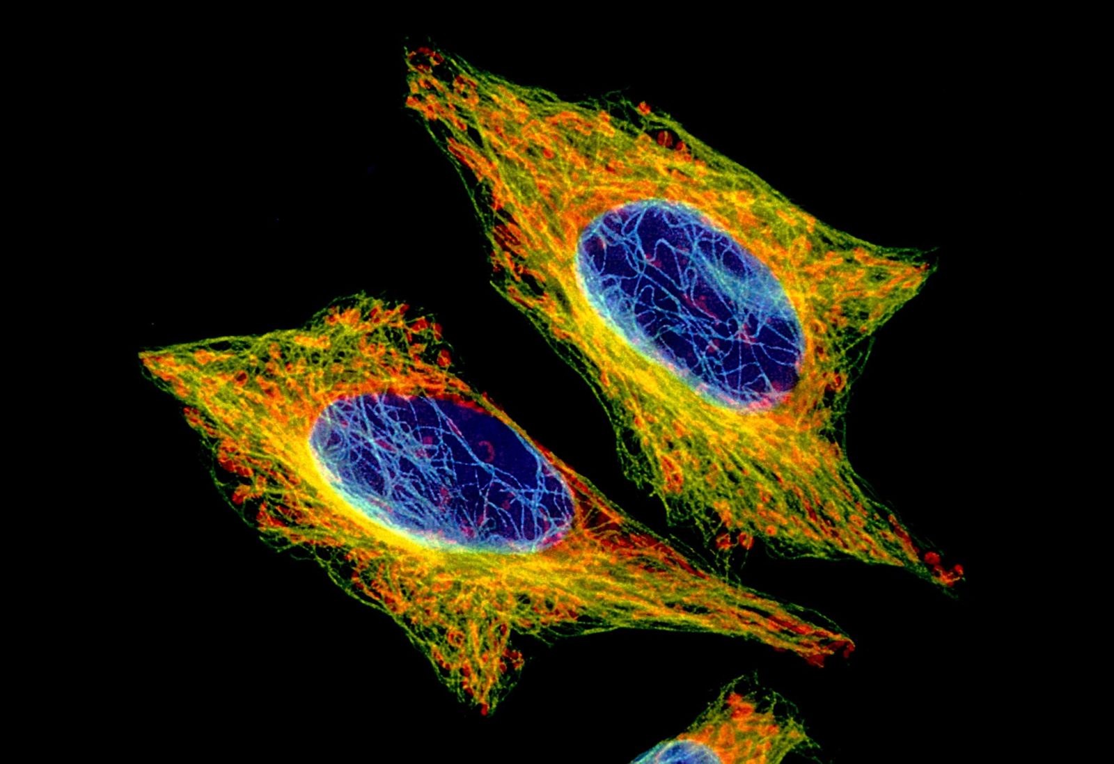 HeLa (cancer) cells in culture | Nikon Small World