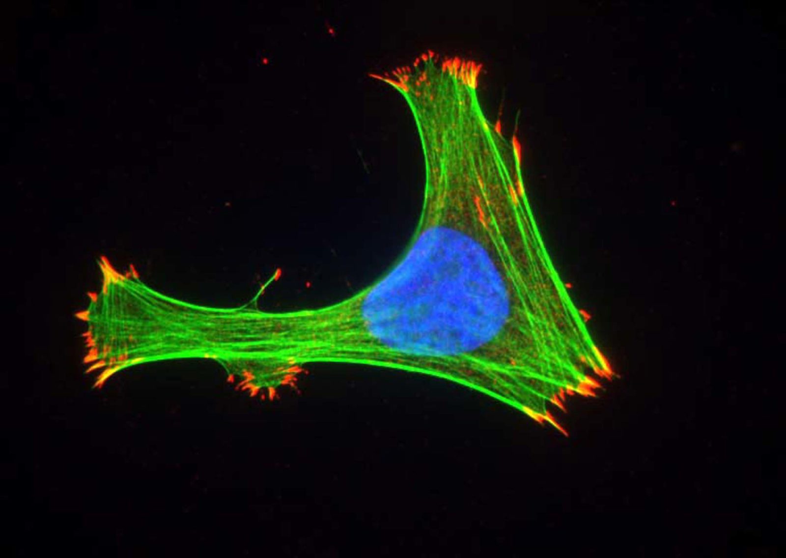 Human osteosarcoma cells | Nikon Small World