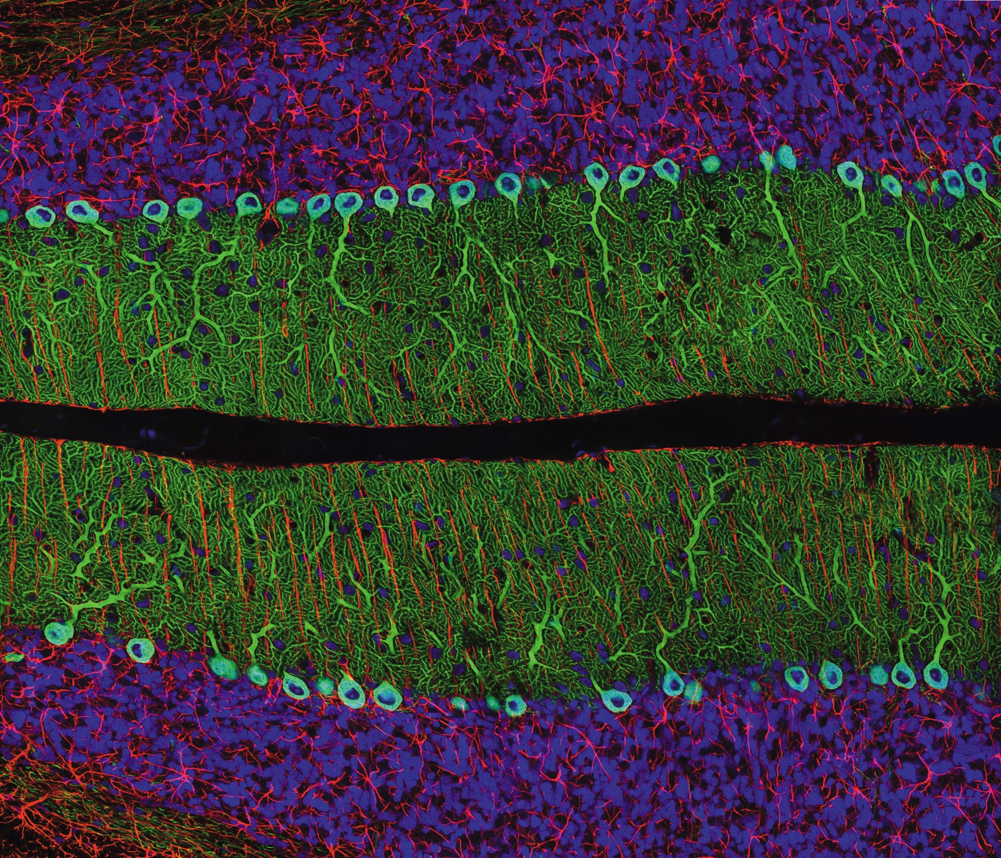 Sagittal section of rat cerebellum | Nikon Small World