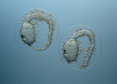 Tunicate larvae within eggs | Nikon Small World