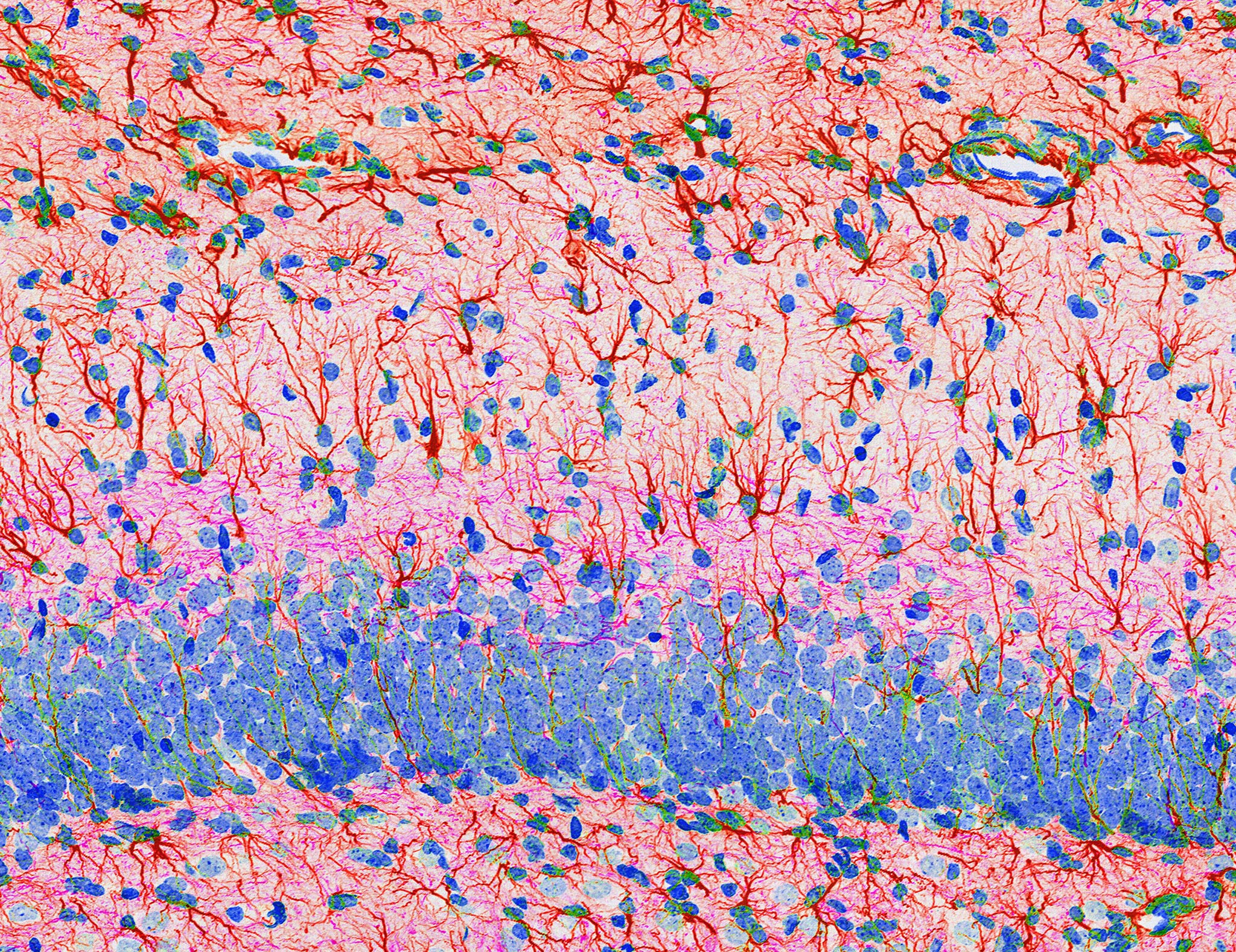 Stained rat brain section | Nikon Small World