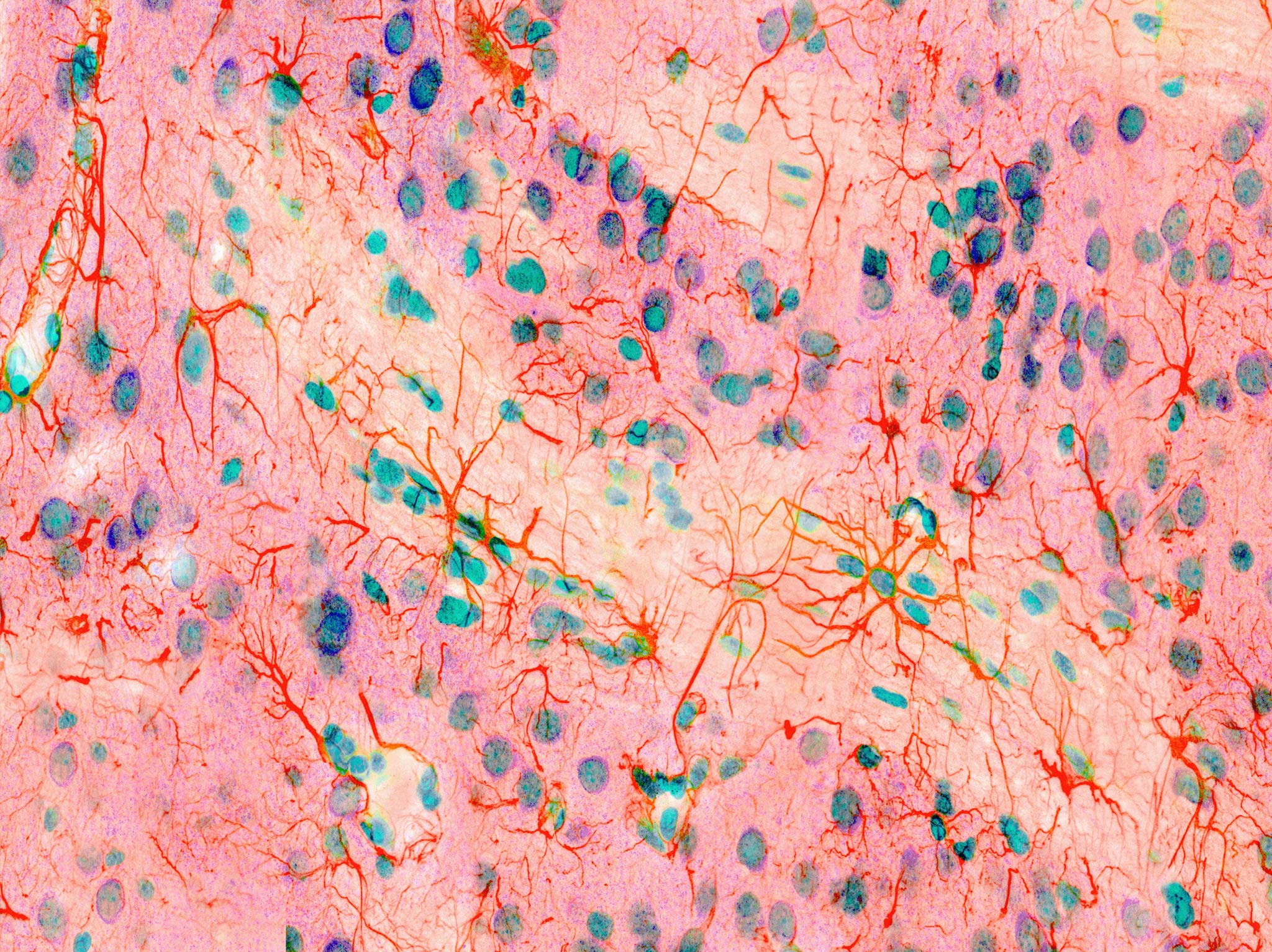 Stained rat brain section | Nikon Small World