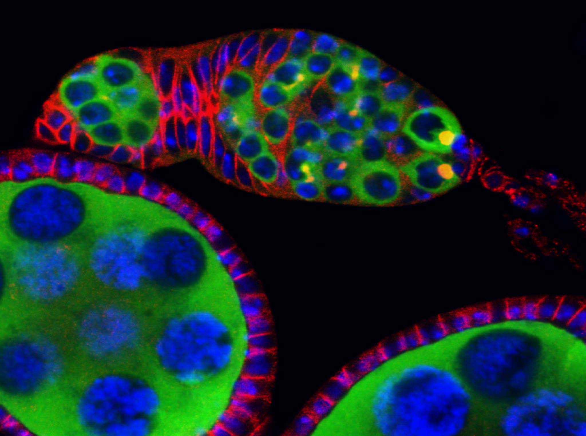 Section of a Drosophila (fruit fly) ovary (germarium) | Nikon Small World