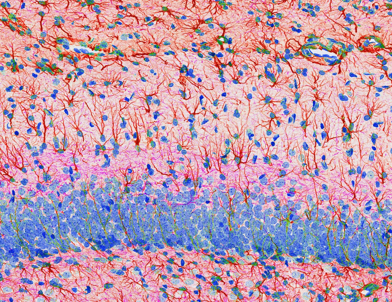 Stained rat brain section | Nikon Small World
