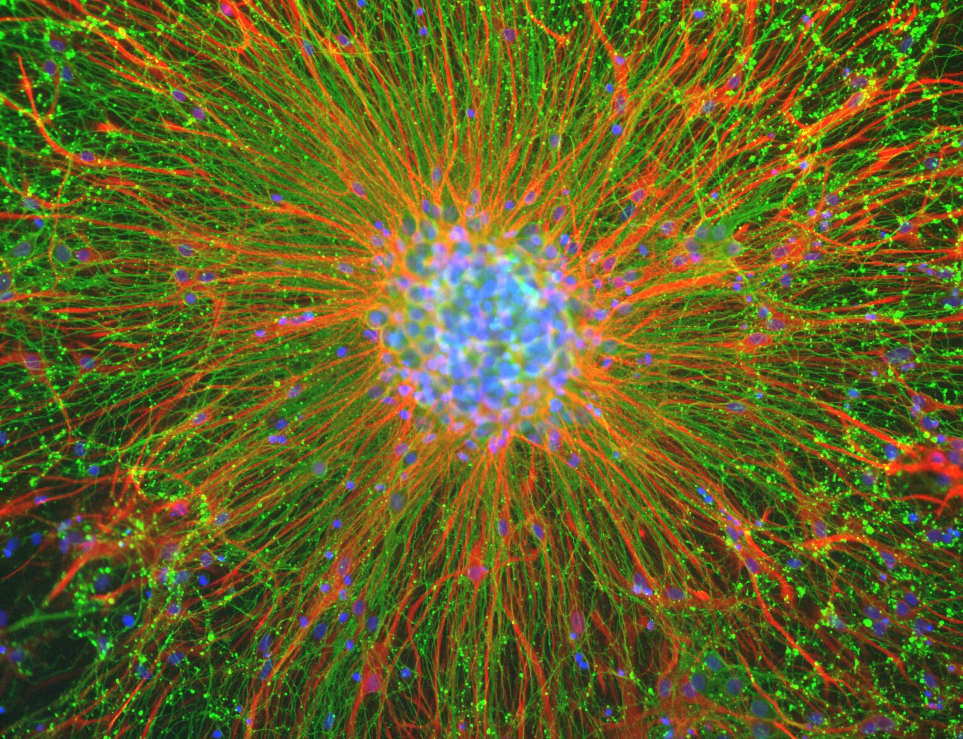 Cortical neurons (brain cells) of an embryonic rat | Nikon Small World