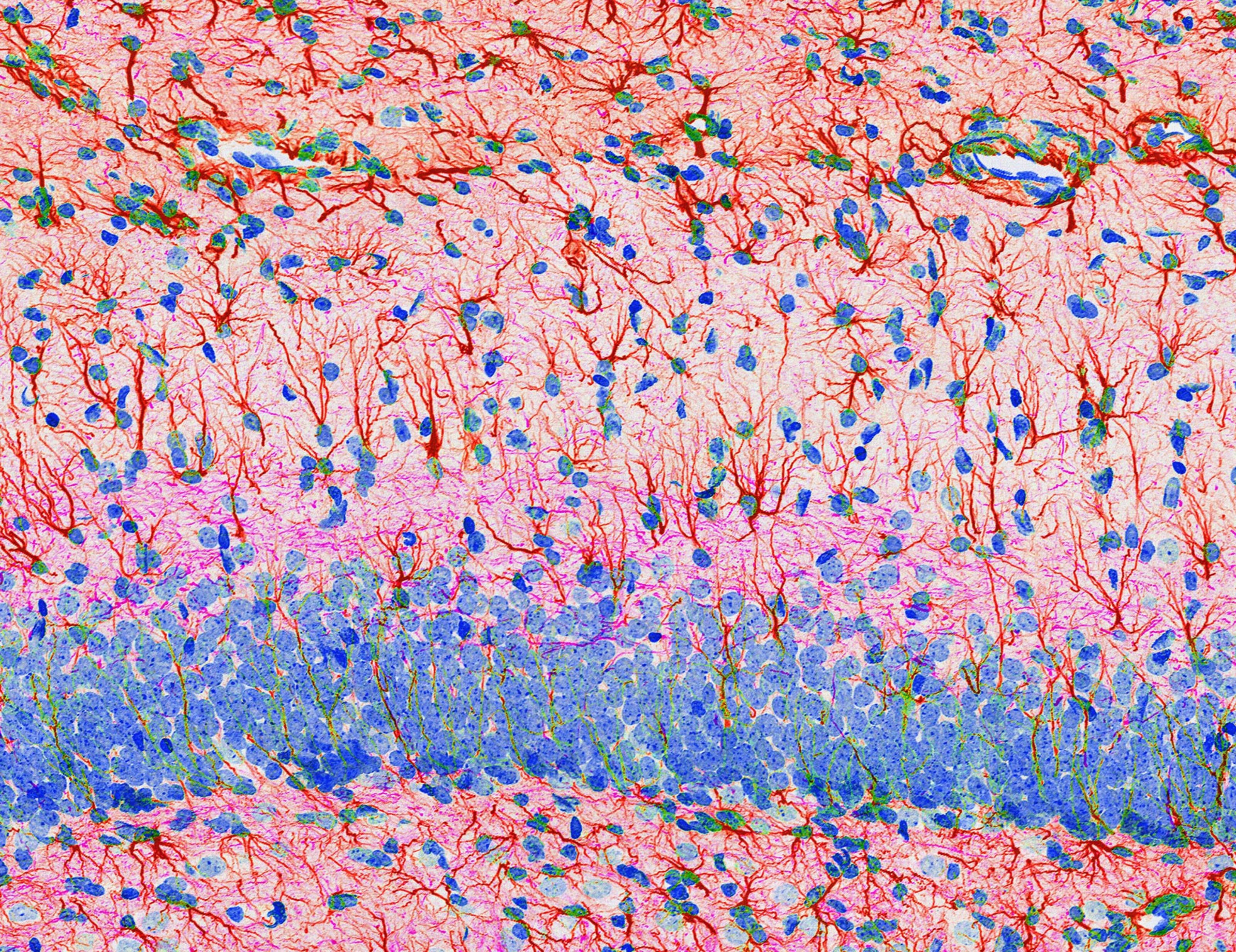 Stained rat brain section | Nikon Small World