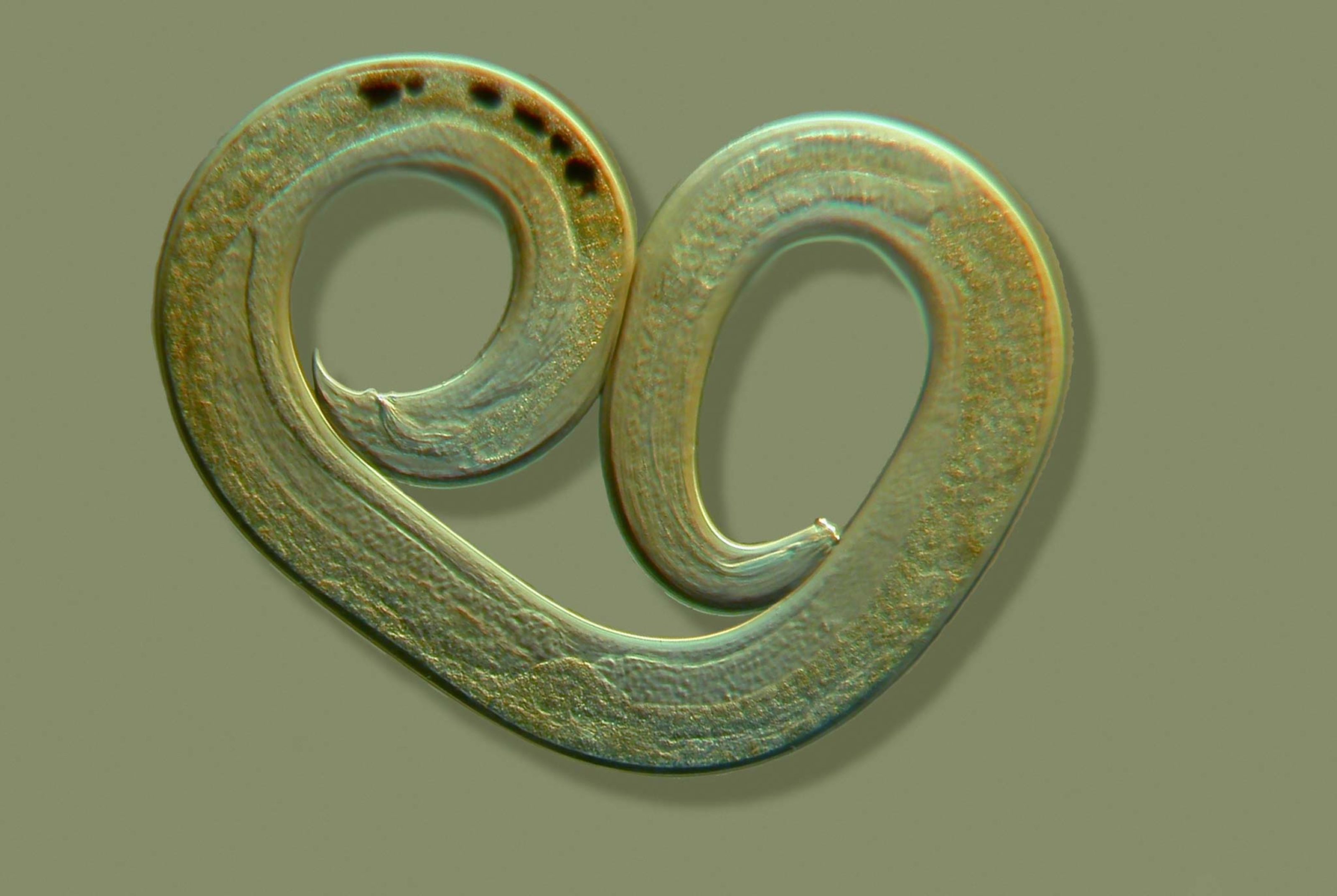 Dorylaim sp., a plant-parasitic nematode (worm) | Nikon Small World