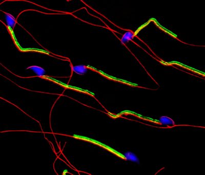 Mouse spermatozoa | Nikon Small World