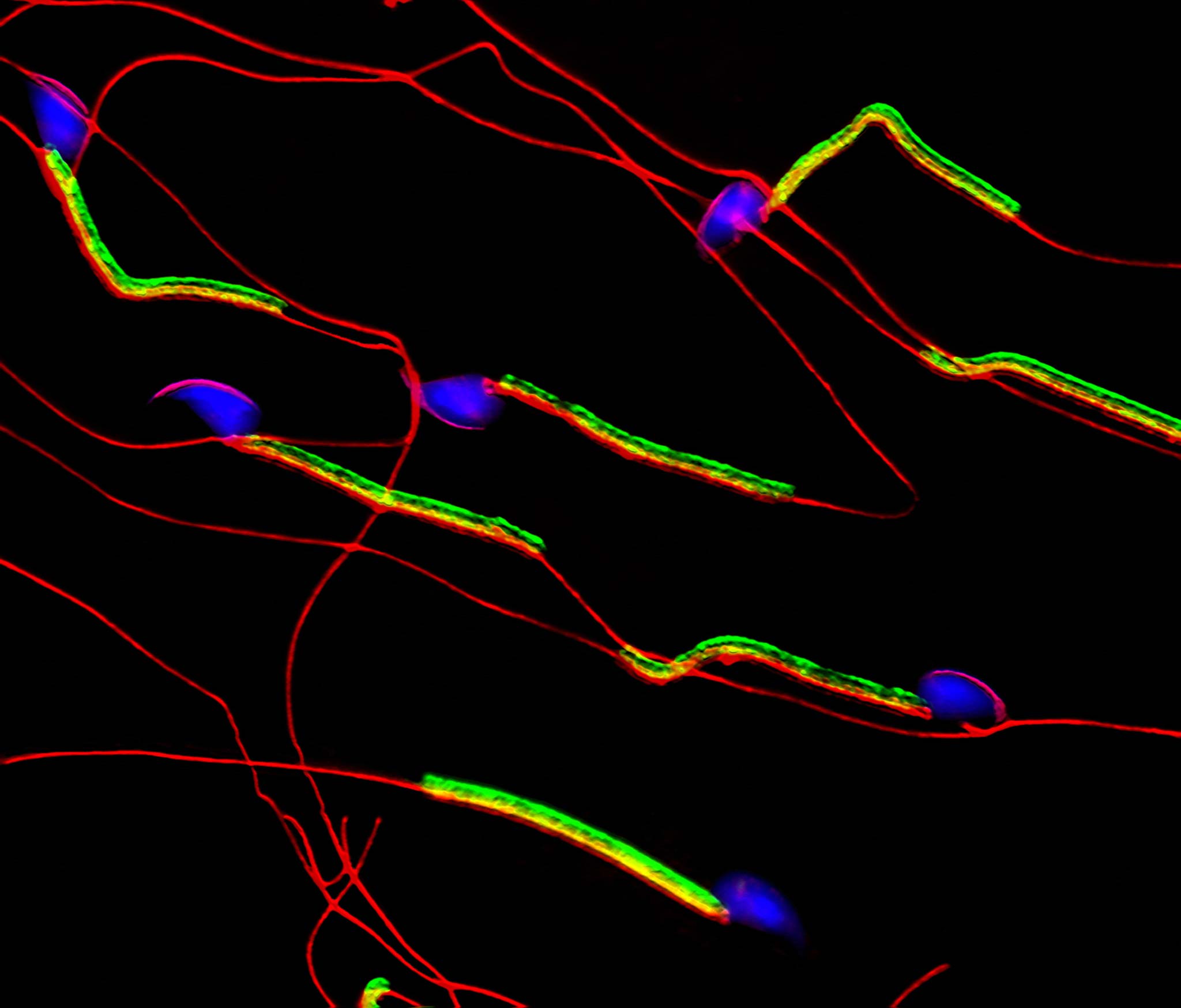 Mouse spermatozoa | Nikon Small World