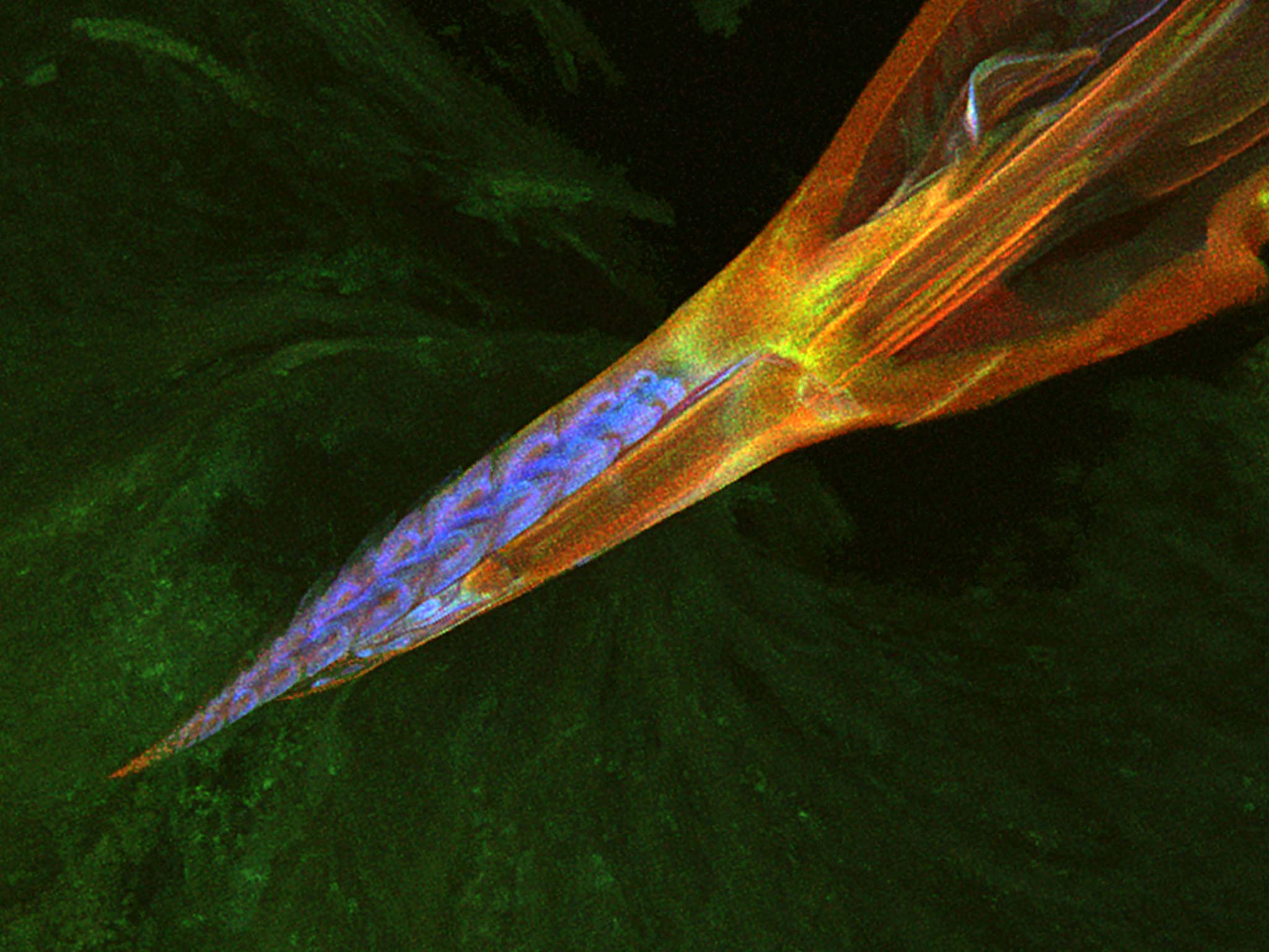 Ixodes scapularis (deer tick) hypostome attached to the ear of a ...