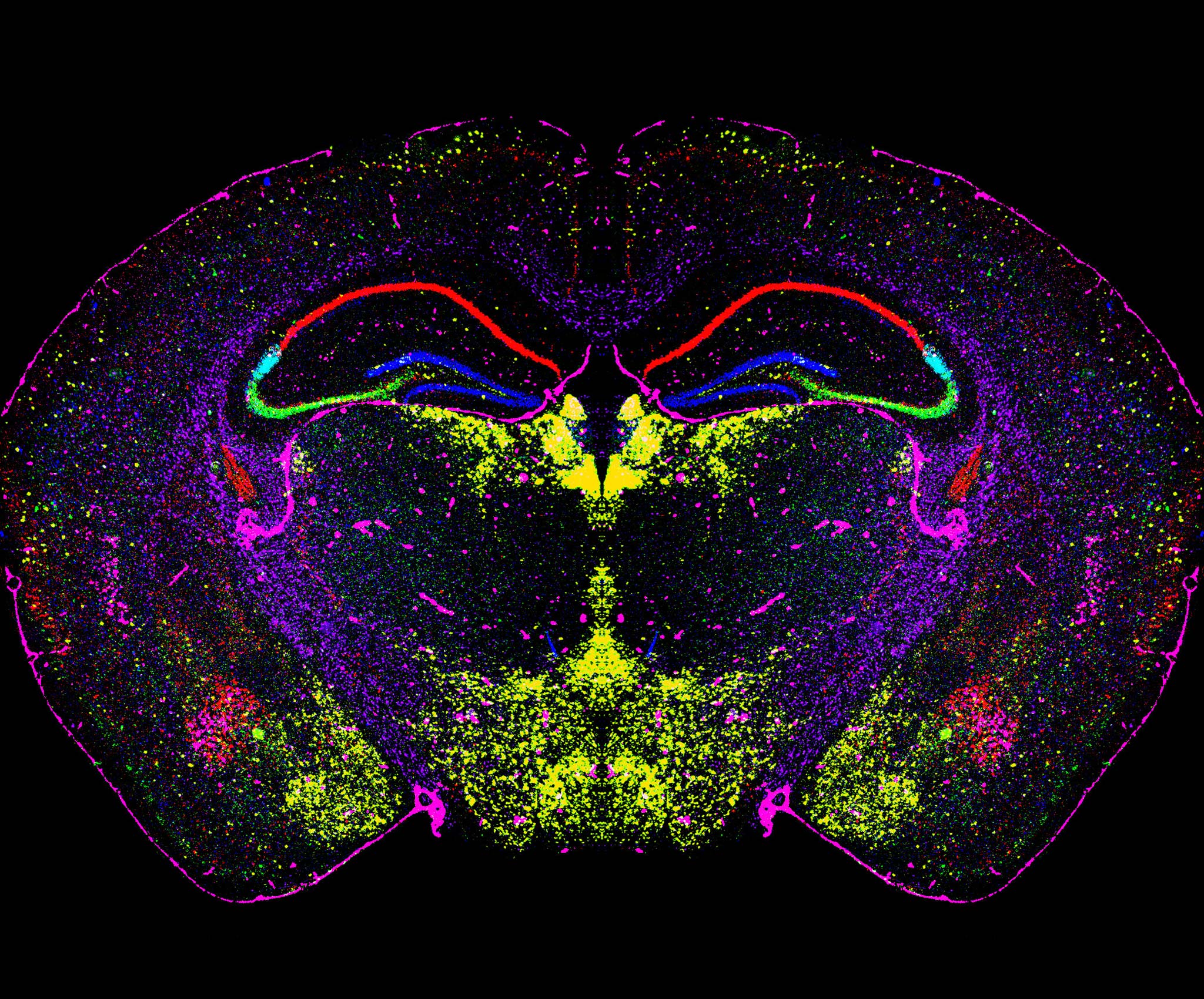 Coronal sections of a 10 week old mouse brain | Nikon Small World