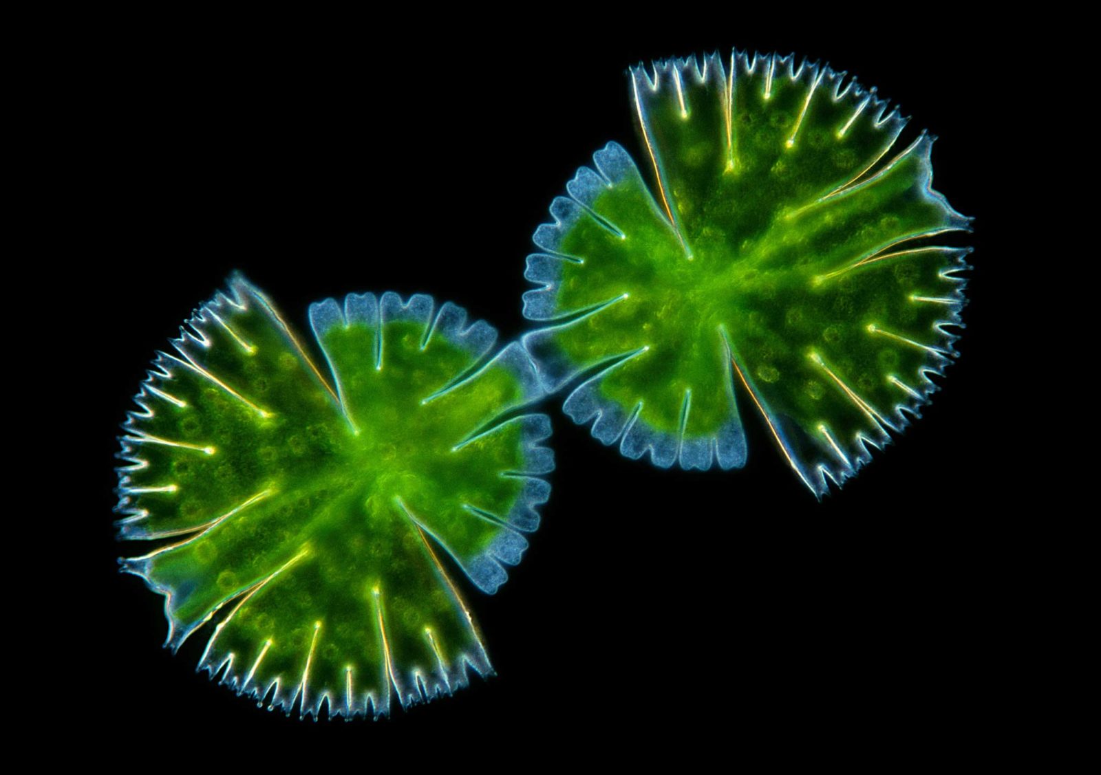 Micrasterias rotata (a desmid) undergoing cell division | Nikon Small World