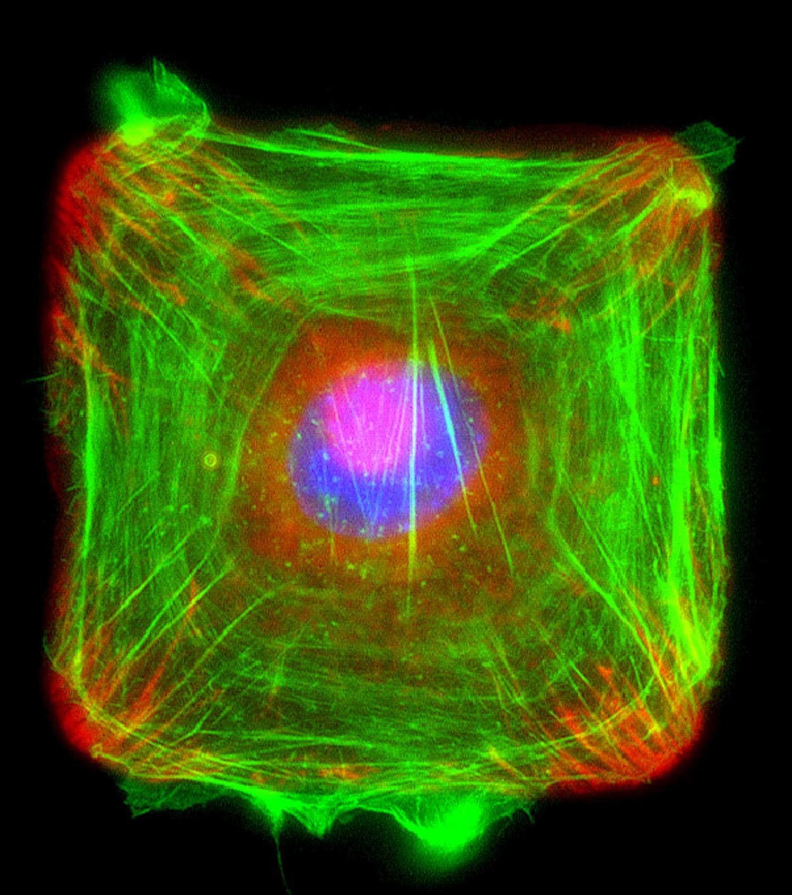 Human microvascular endothelial cell | Nikon Small World
