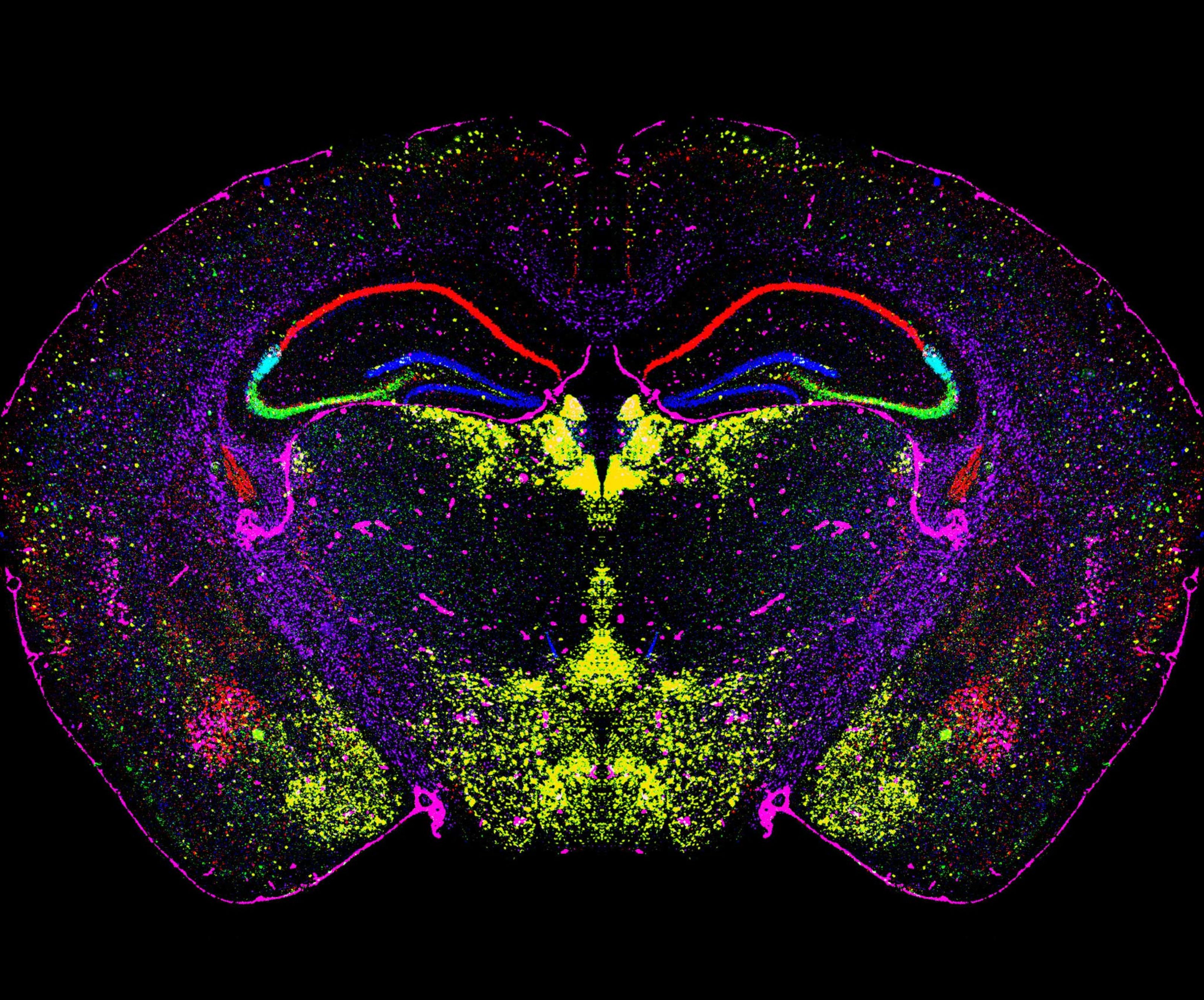 Coronal sections of a 10 week old mouse brain | Nikon Small World