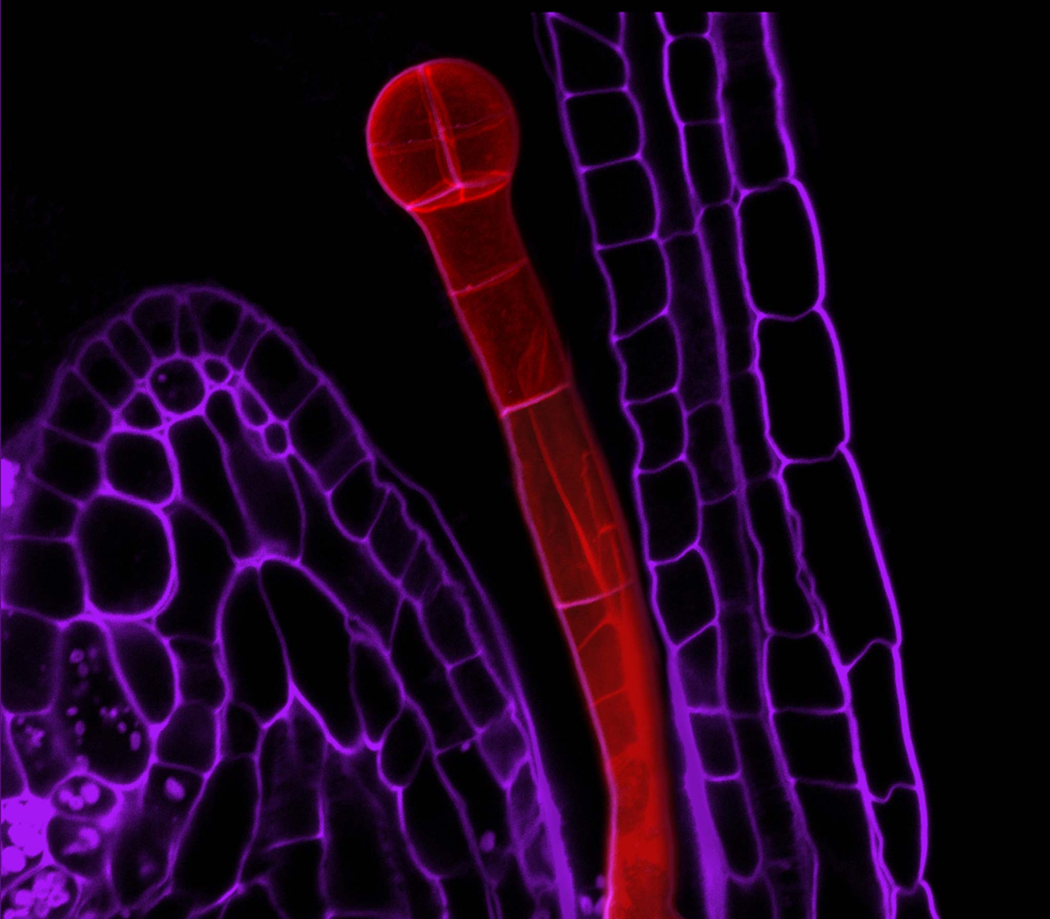 Eight-cell plant embryo | Nikon Small World