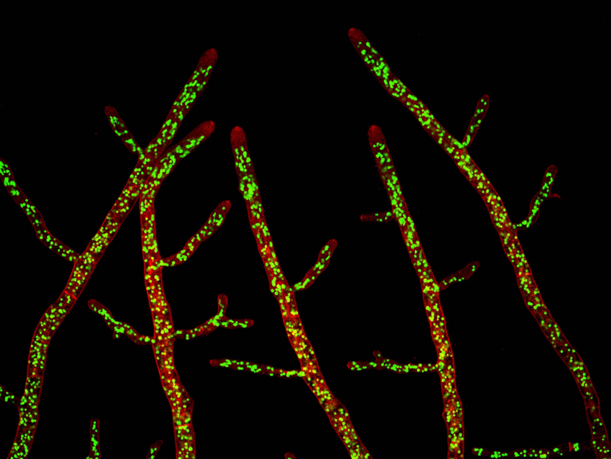 Hyphal tips of Neurospora crassa (a filamentous fungus) | Nikon Small World