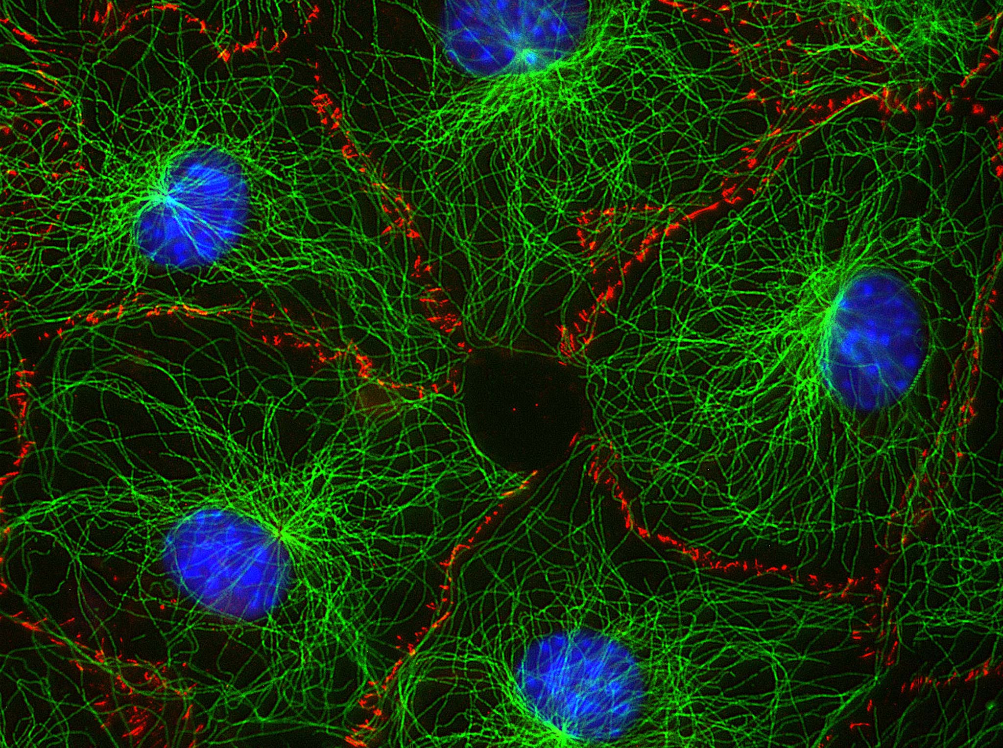 NIH 3T3 fibroblasts (mouse cells) | Nikon Small World