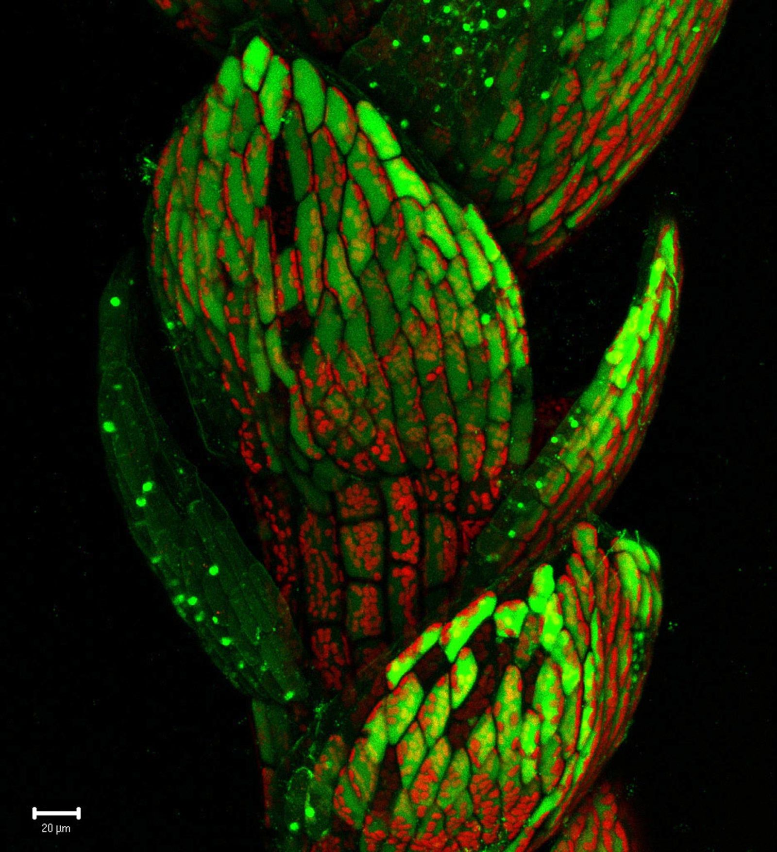 Leaf-like structures of a moss gametophyte | Nikon Small World
