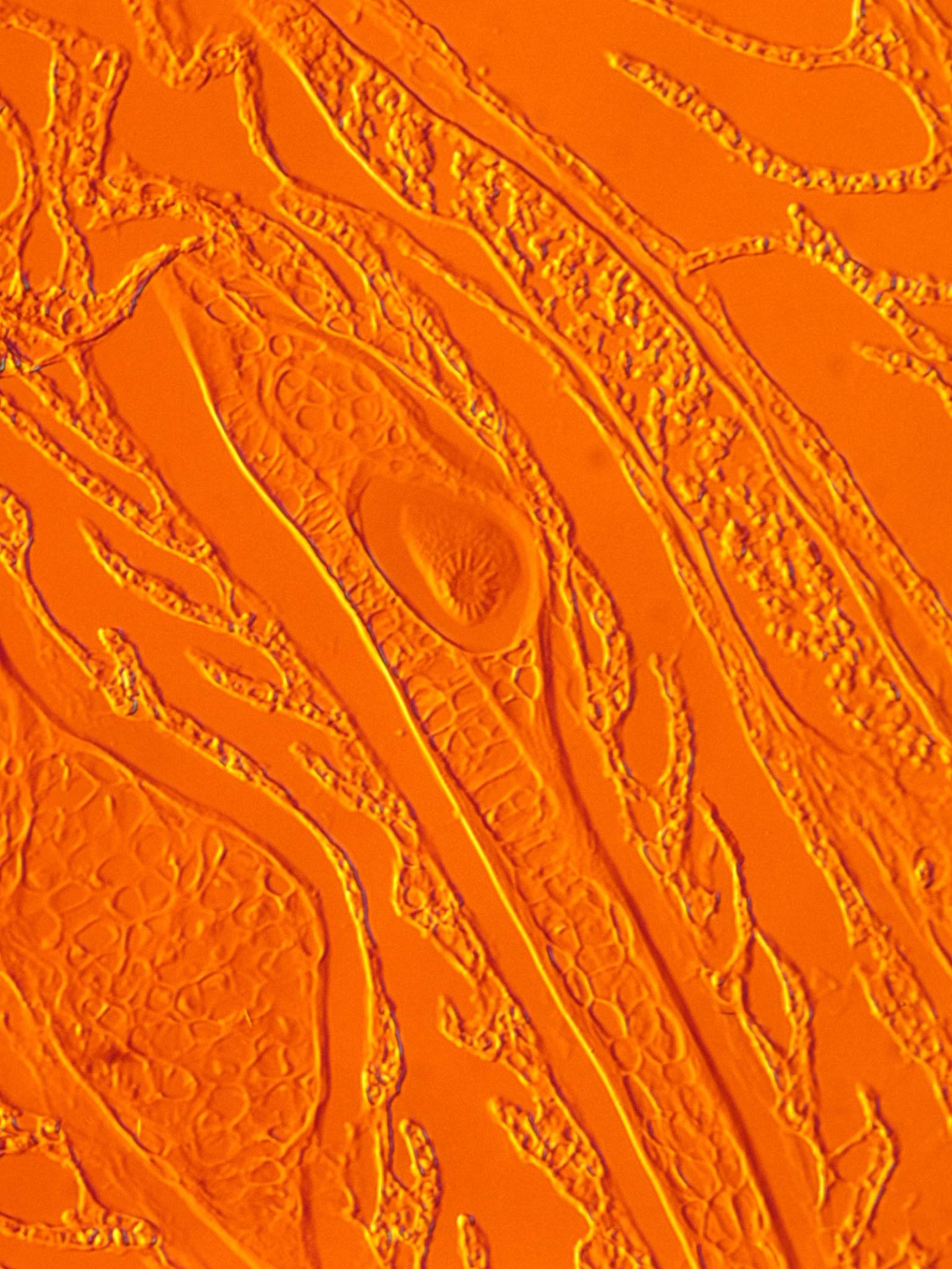 Fresh gill tissue from fish (Gillichthys mirabilis) | Nikon Small World