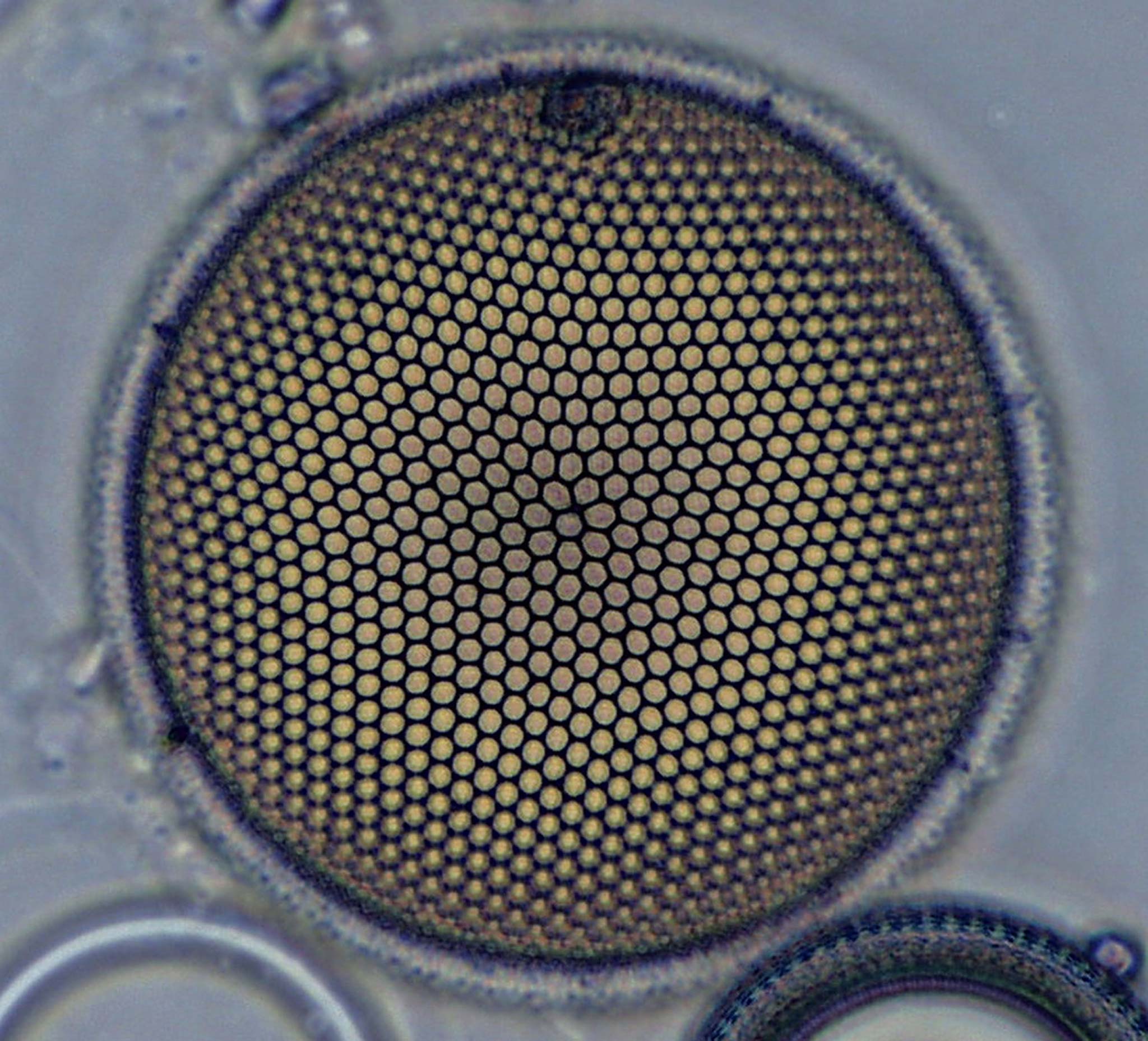 Marine diatom (Thalassiosira) | Nikon Small World
