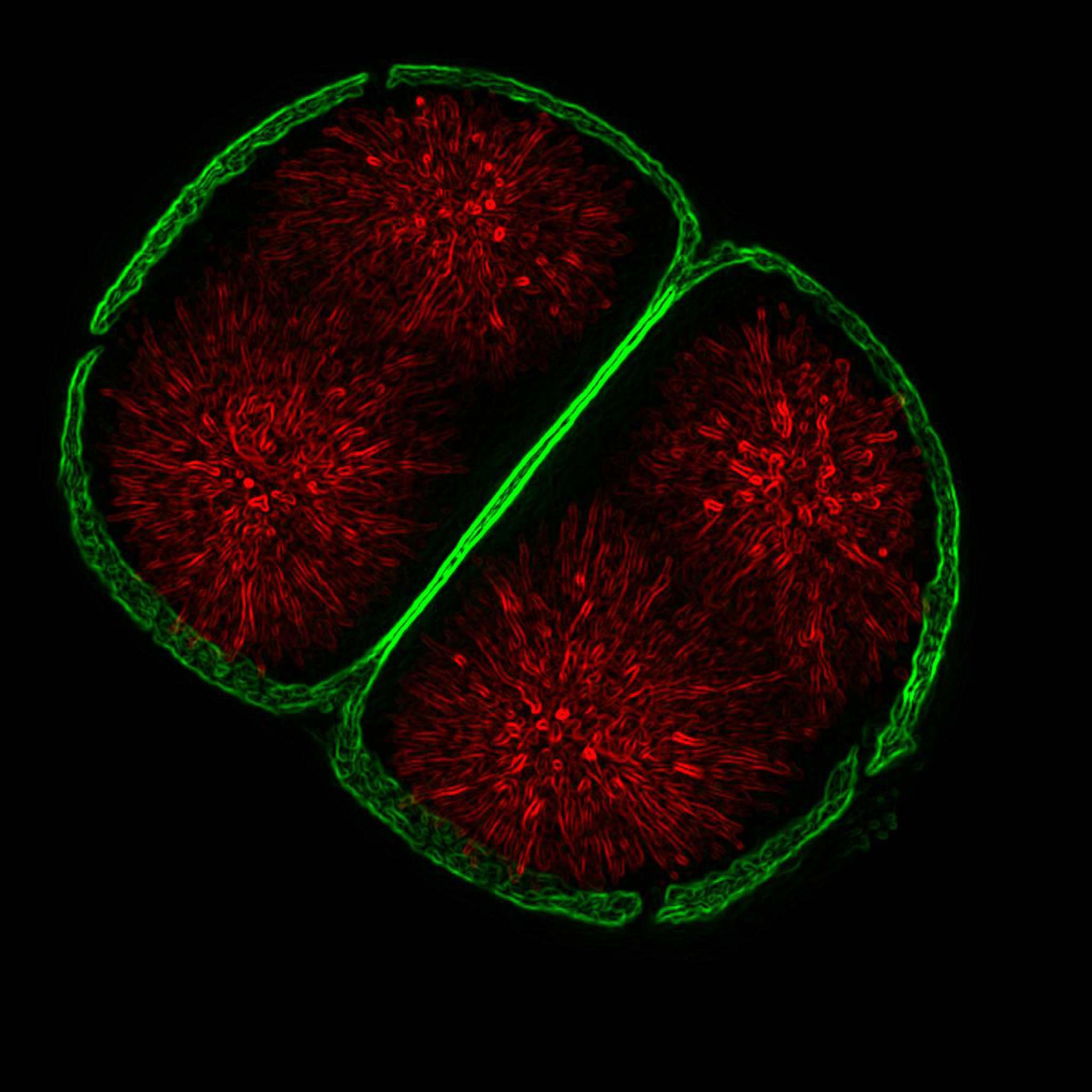 Sea urchin embryo | Nikon Small World