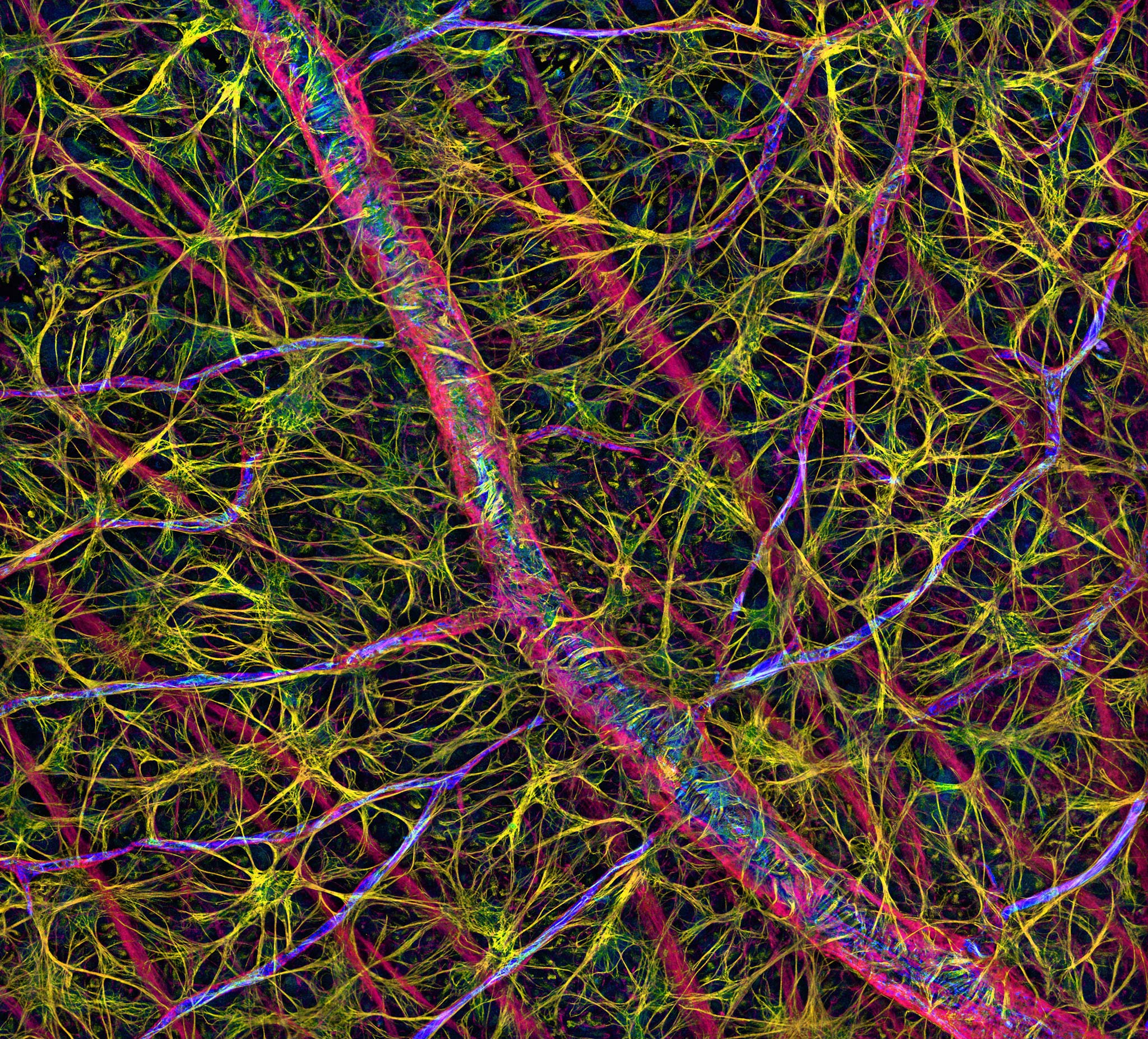 Rat retina astrocytes and blood vessels | Nikon Small World
