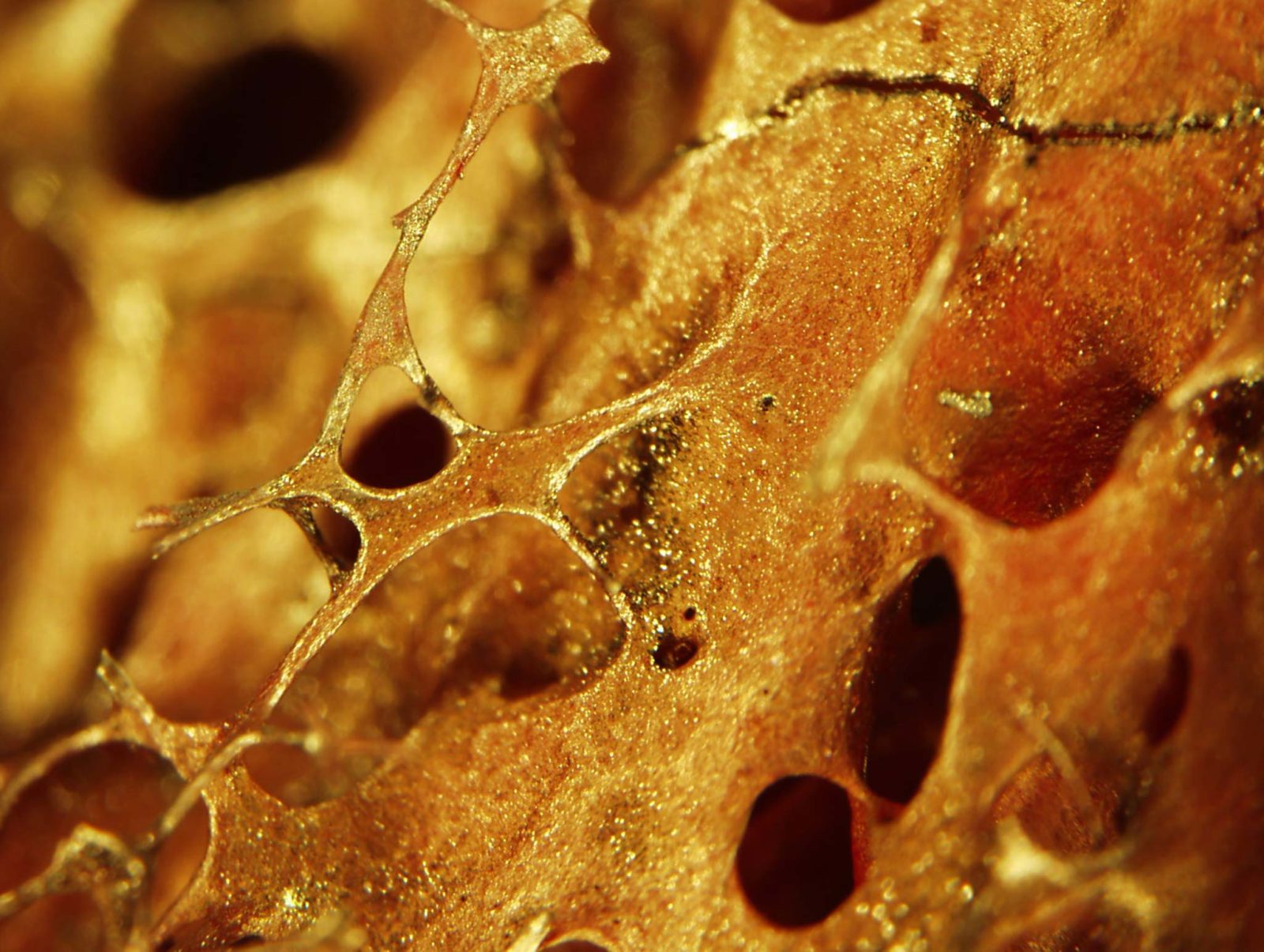 Trabecular bone | Nikon Small World