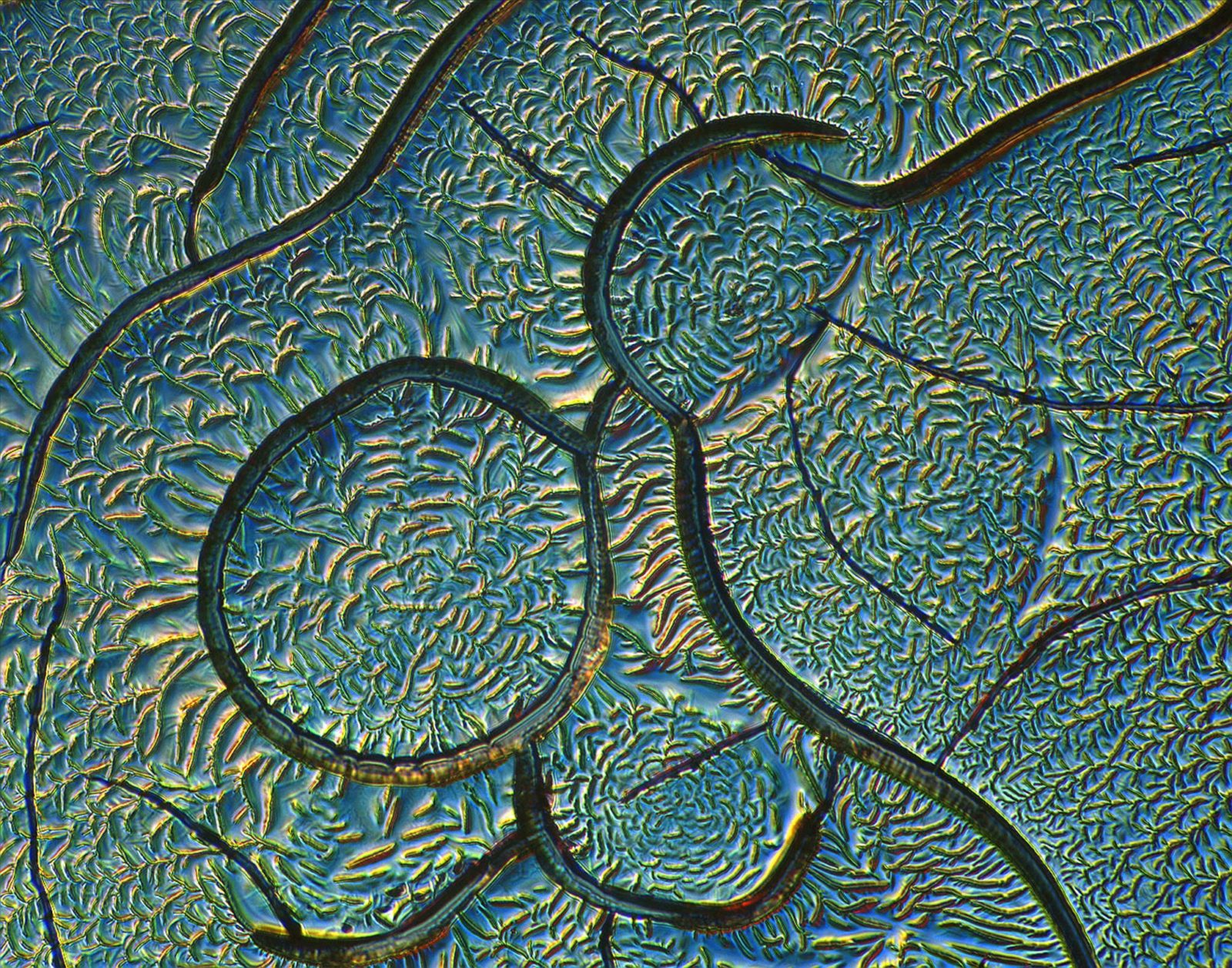 Donkey serum | Nikon Small World