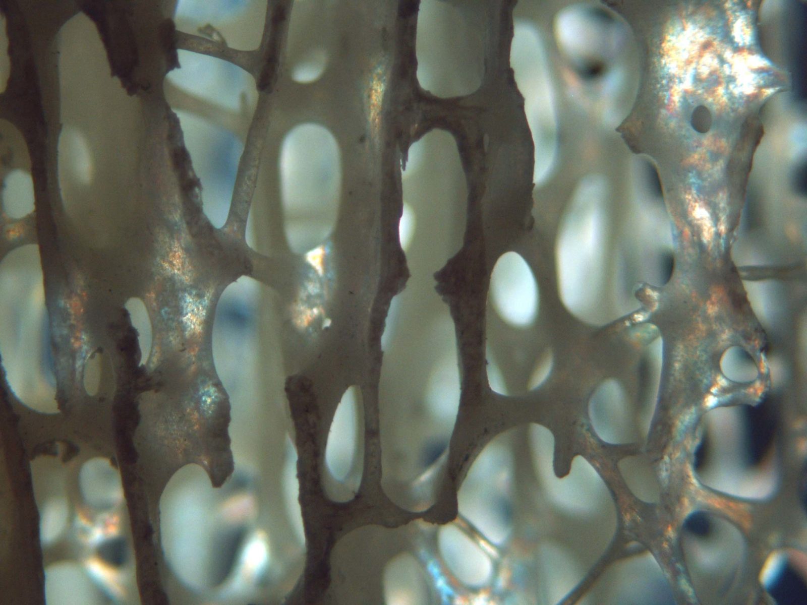 Lumbar vertebral body macerated (Marrow removed) | Nikon Small World