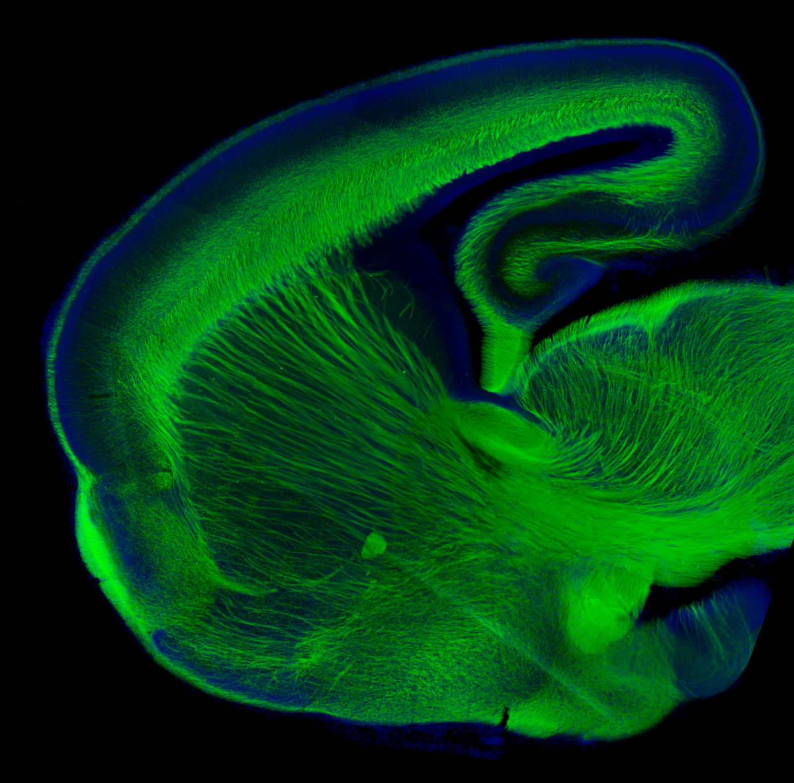 Neonatal mouse brain | Nikon Small World