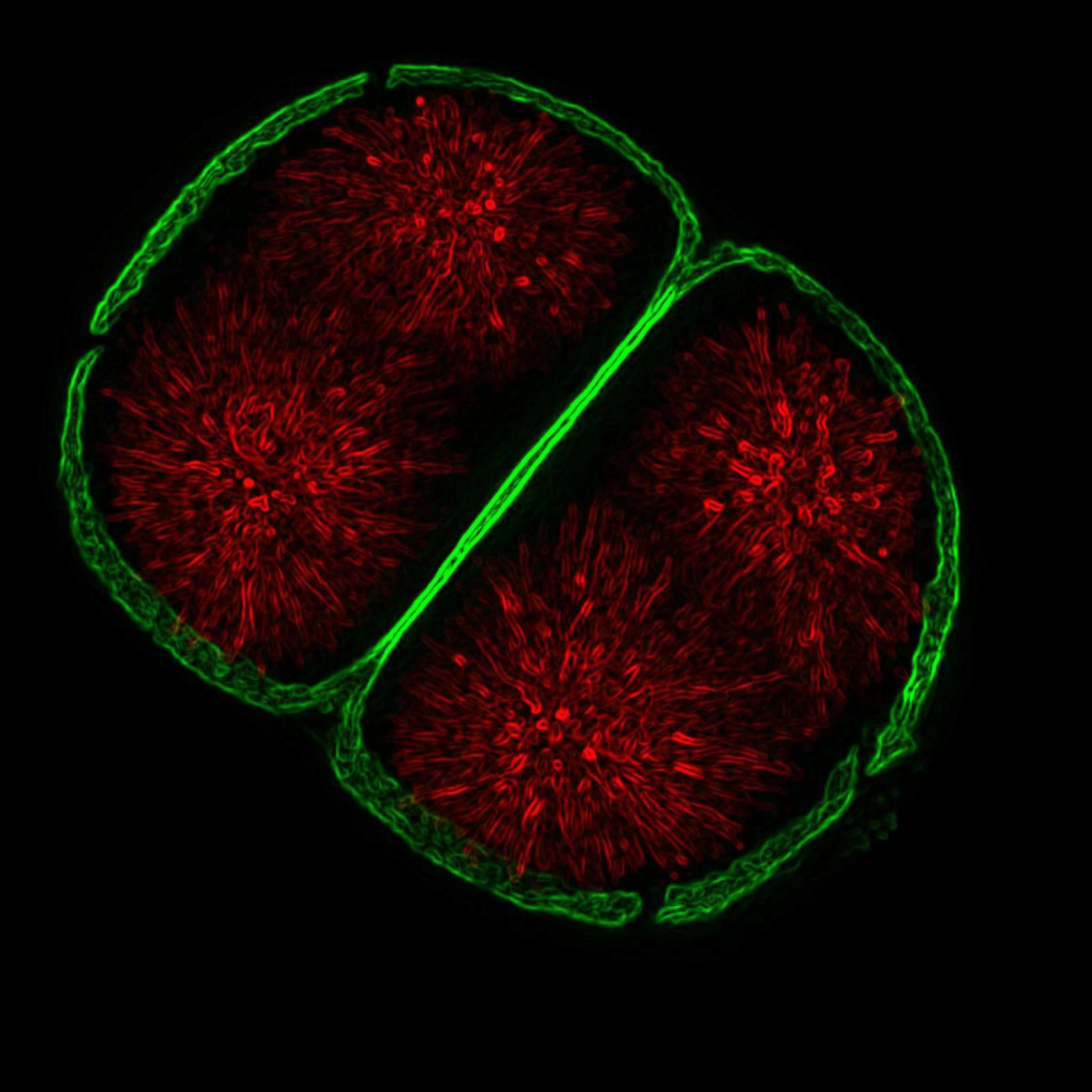Sea urchin embryo | Nikon Small World