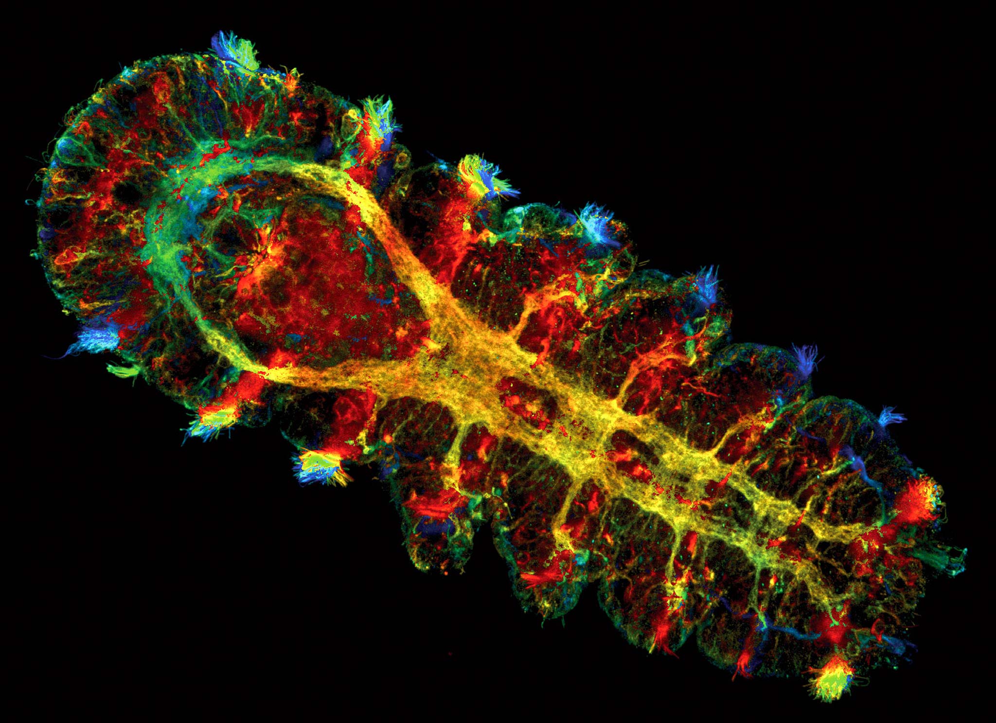 Ophryotrocha diadema (marine worm) embryo, showing nervous system and ...