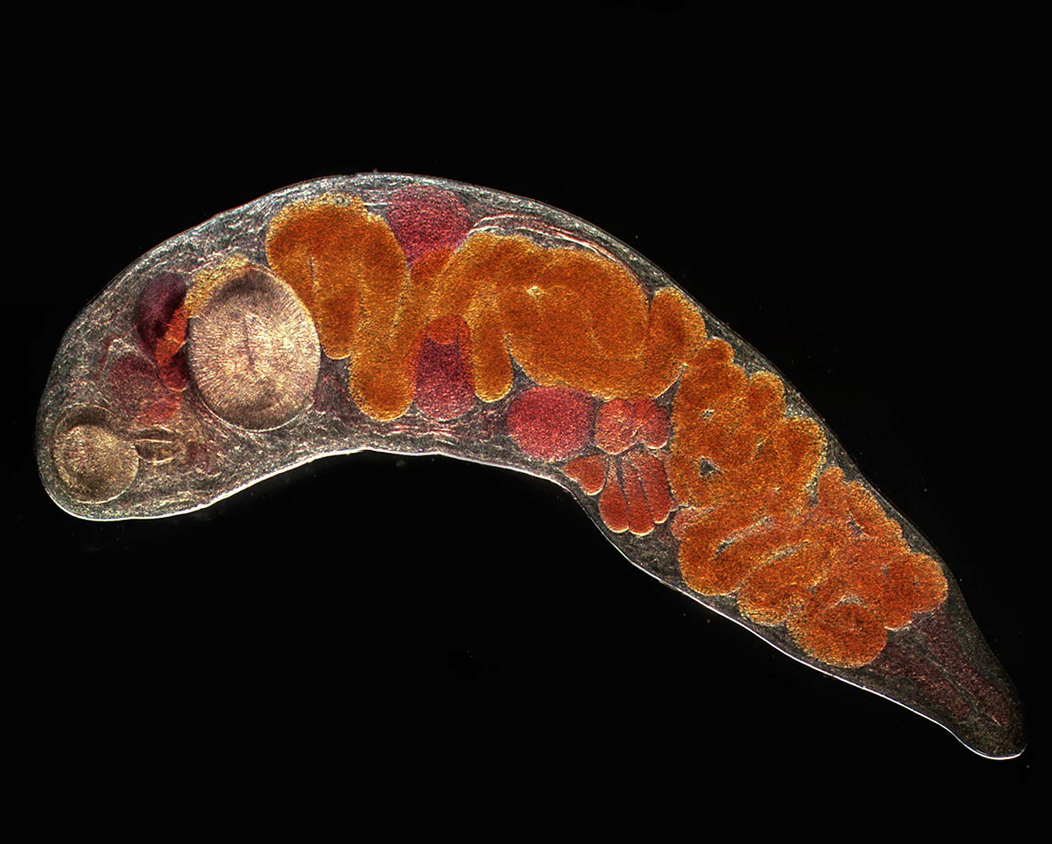Trematode sp. (parasitic worm) | Nikon Small World