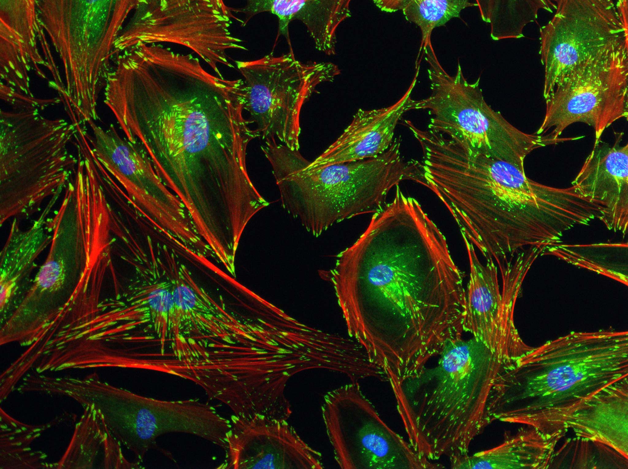 Trabecular meshwork cells from a pig’s eye | Nikon Small World