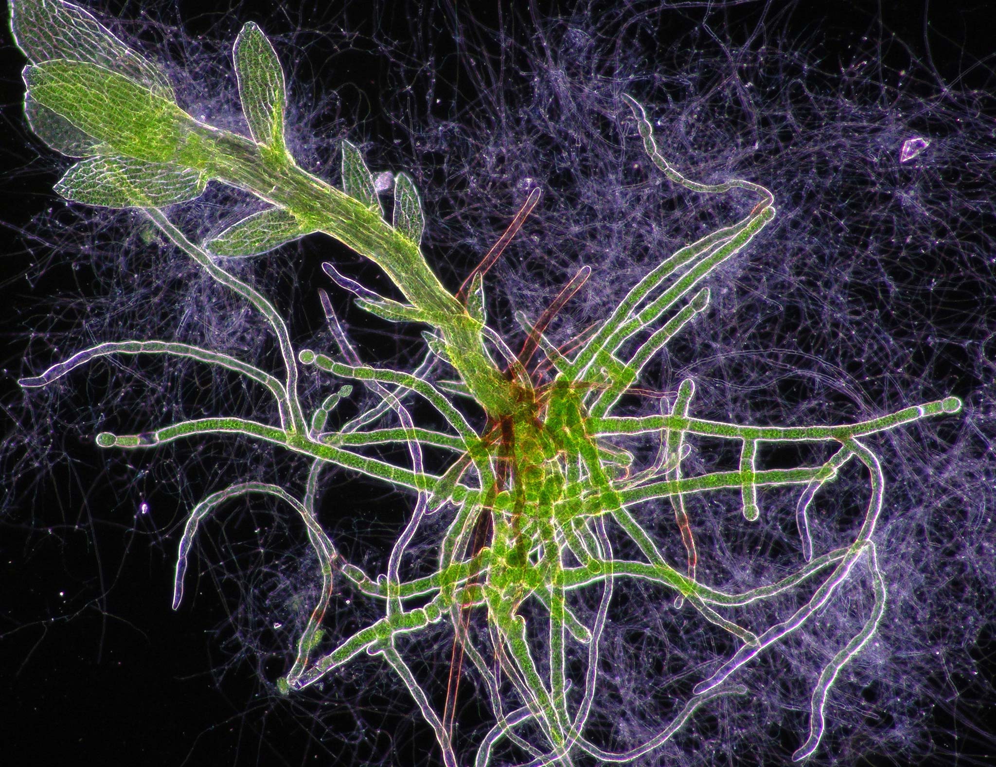 Moss infected with fungus | Nikon Small World