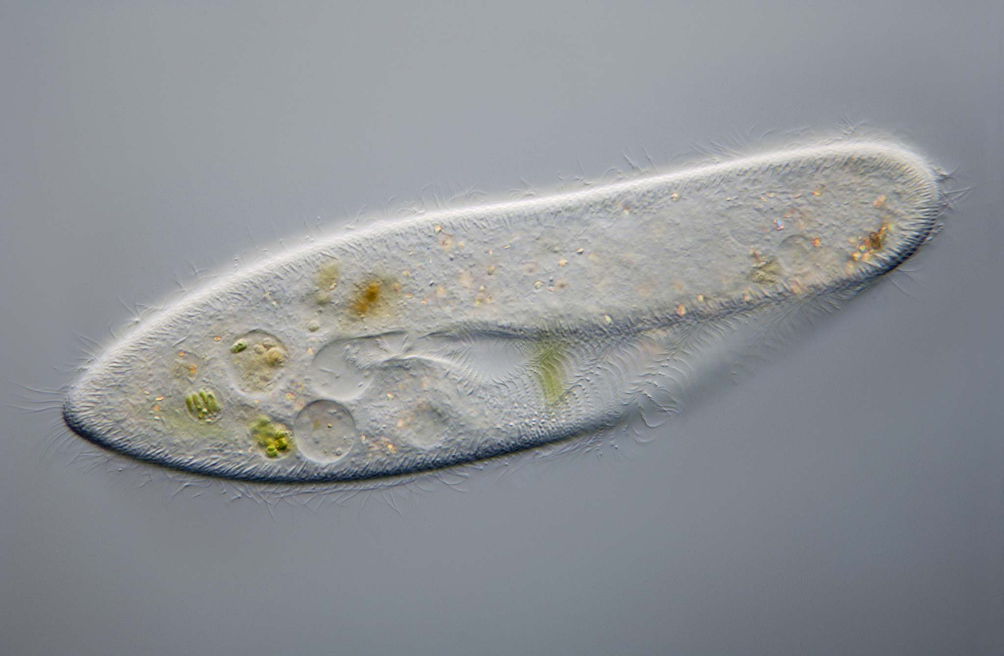 Paramecium feeding | Nikon Small World