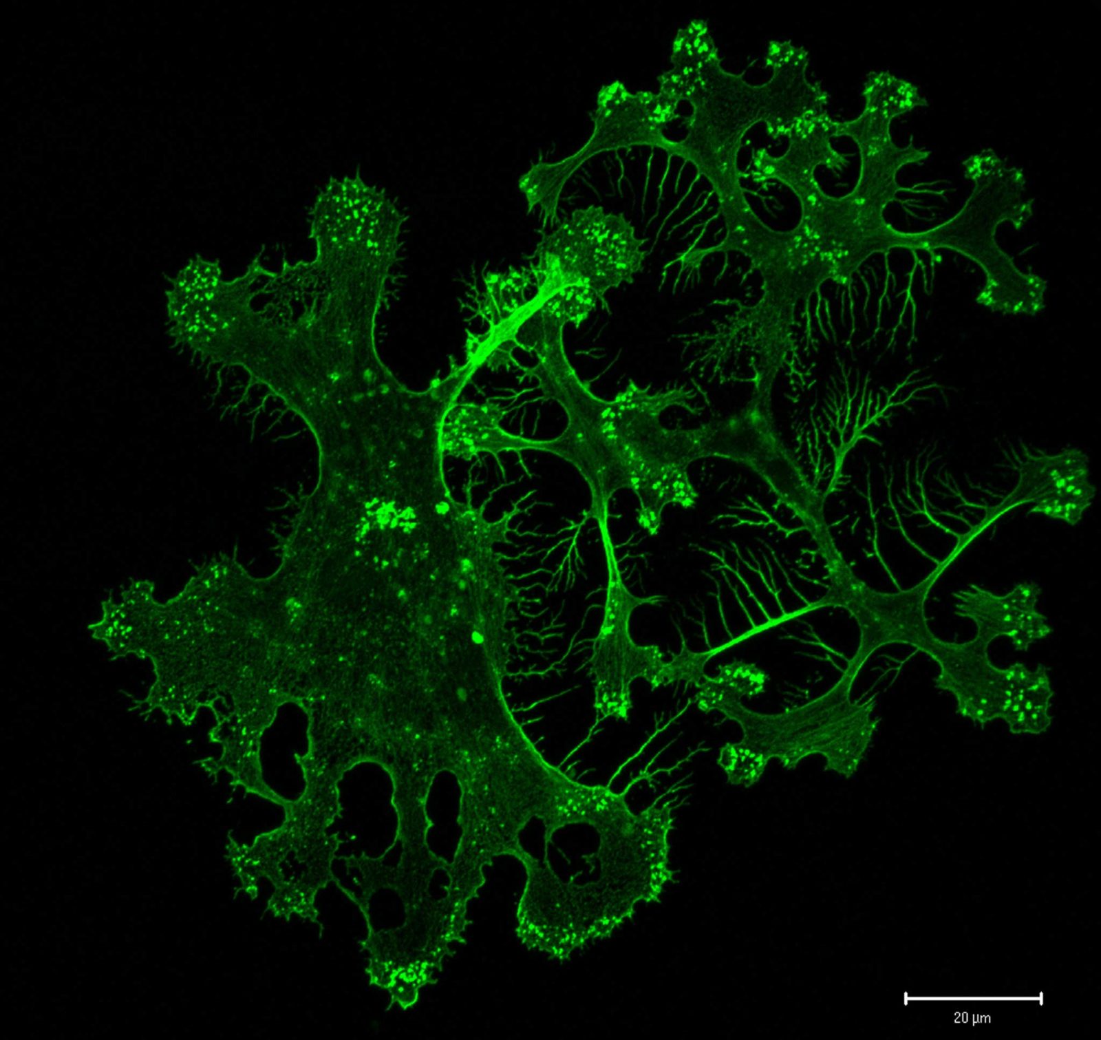 Primary human dendritic cell | Nikon Small World