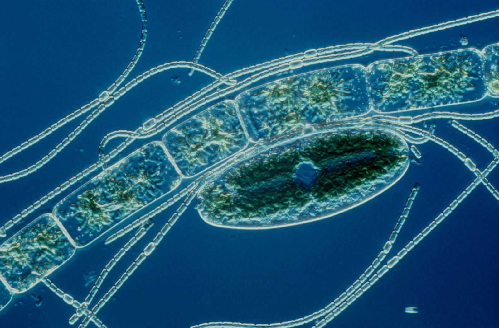 Anabaena sp. (cyanobacterium) and Netrium and Zygnema sp. (green algae ...