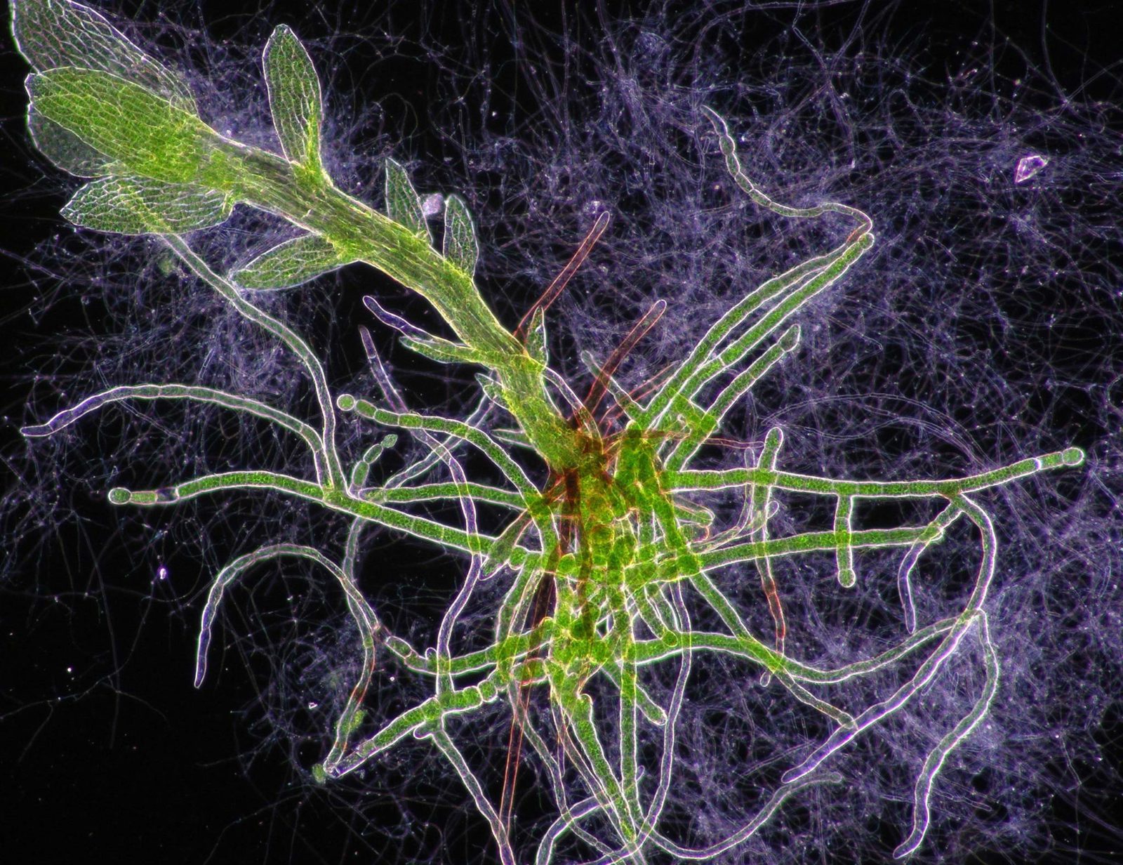 Moss infected with fungus | Nikon Small World