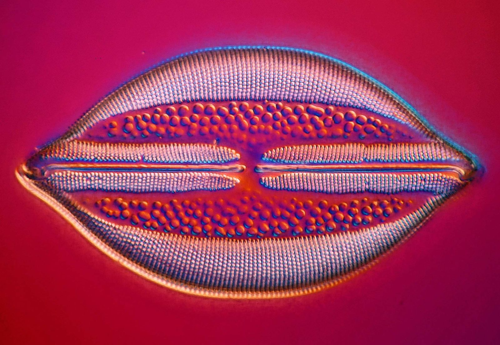 Diatom | Subjects | Nikon Small World