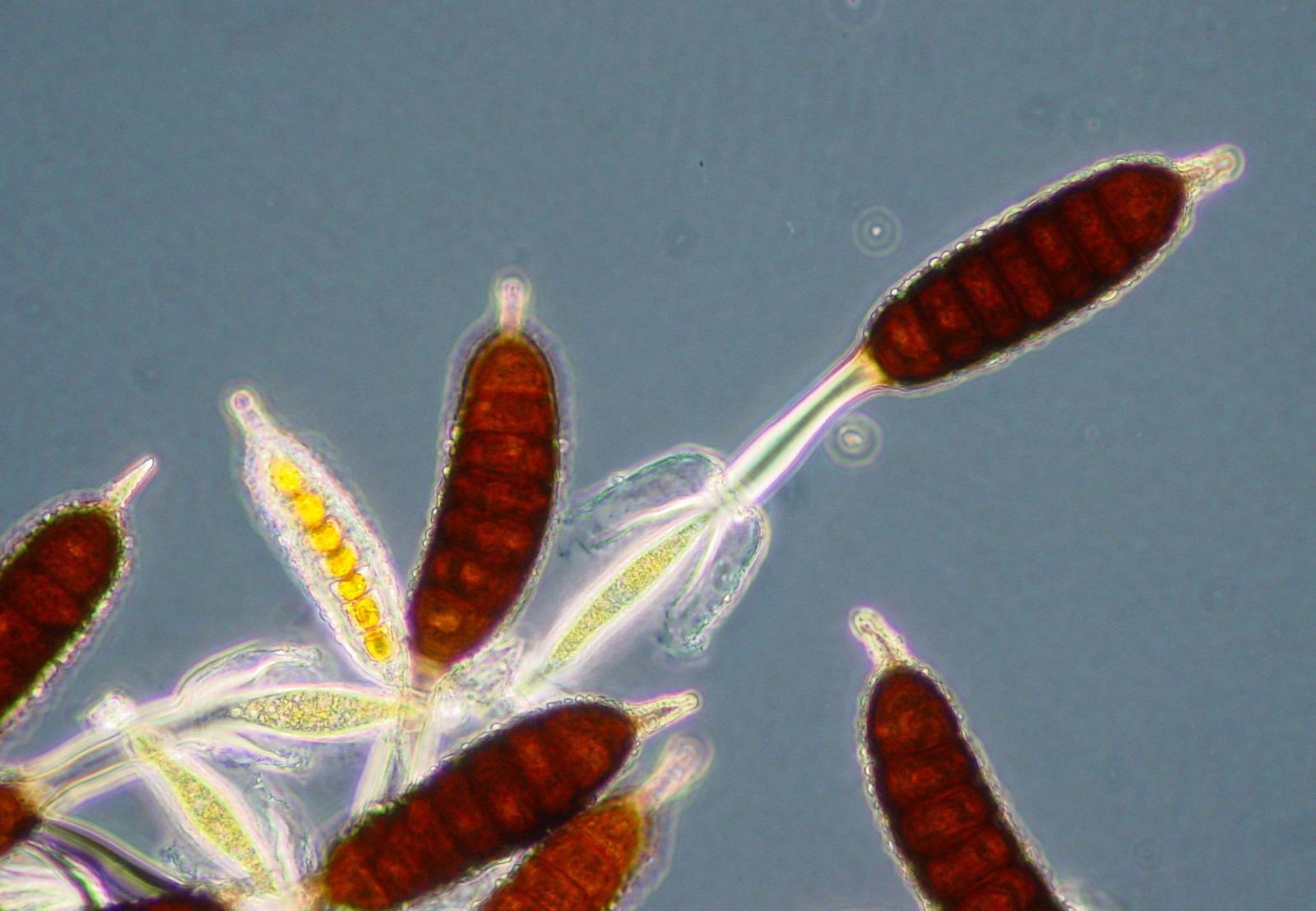 Phragmidium sp. (rust fungus) teleutospores | Nikon Small World