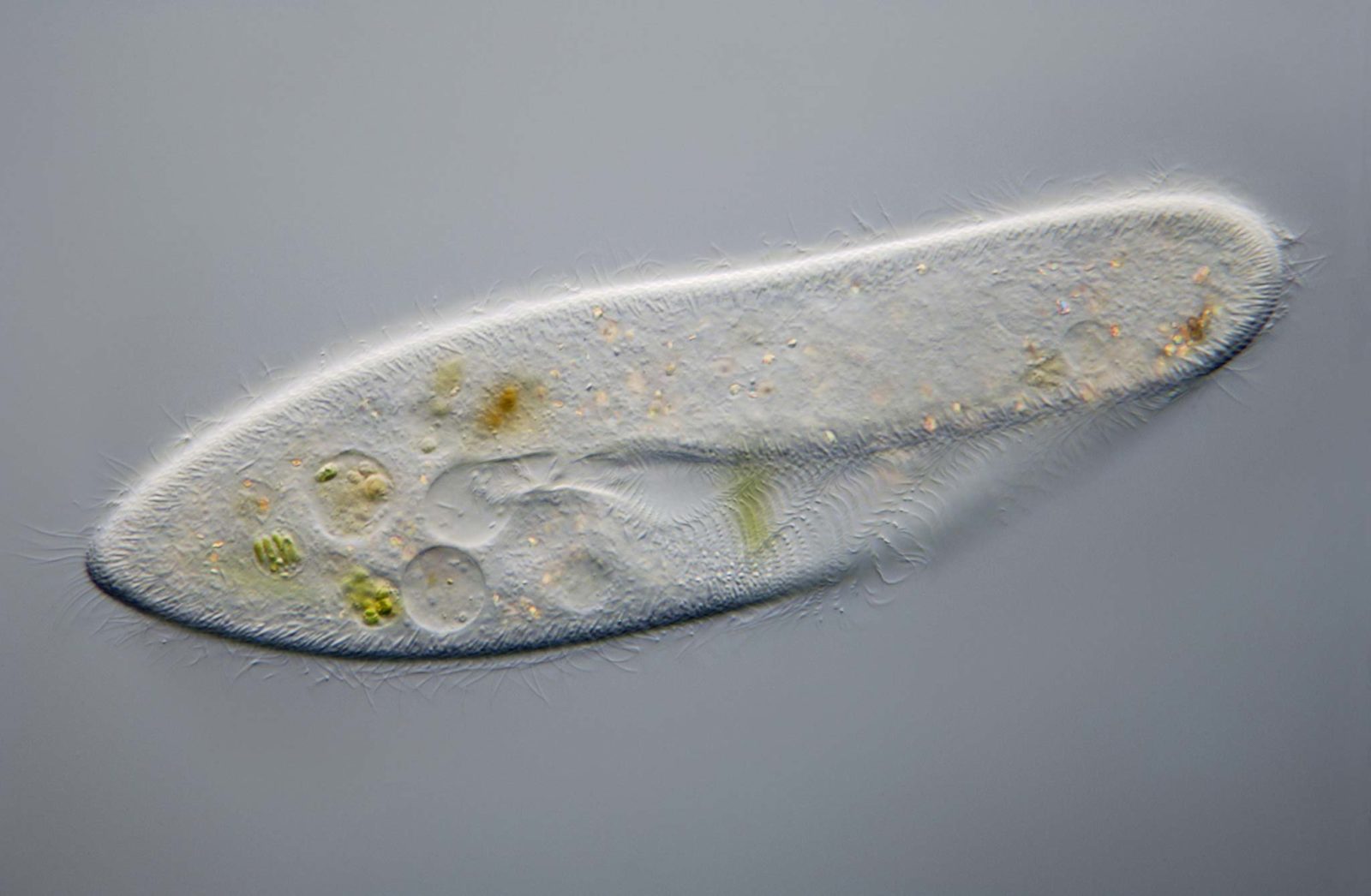 Paramecium feeding | Nikon Small World