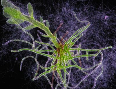Moss infected with fungus | Nikon Small World