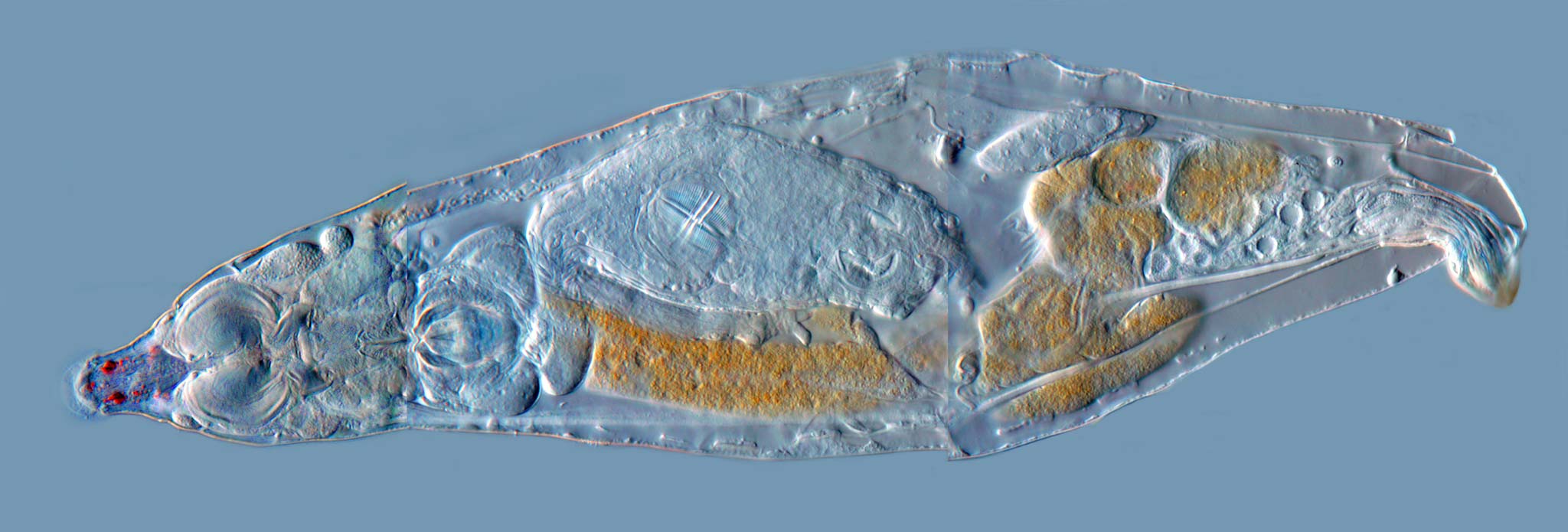 Bdelloid rotifer (composite of three images) | Nikon Small World