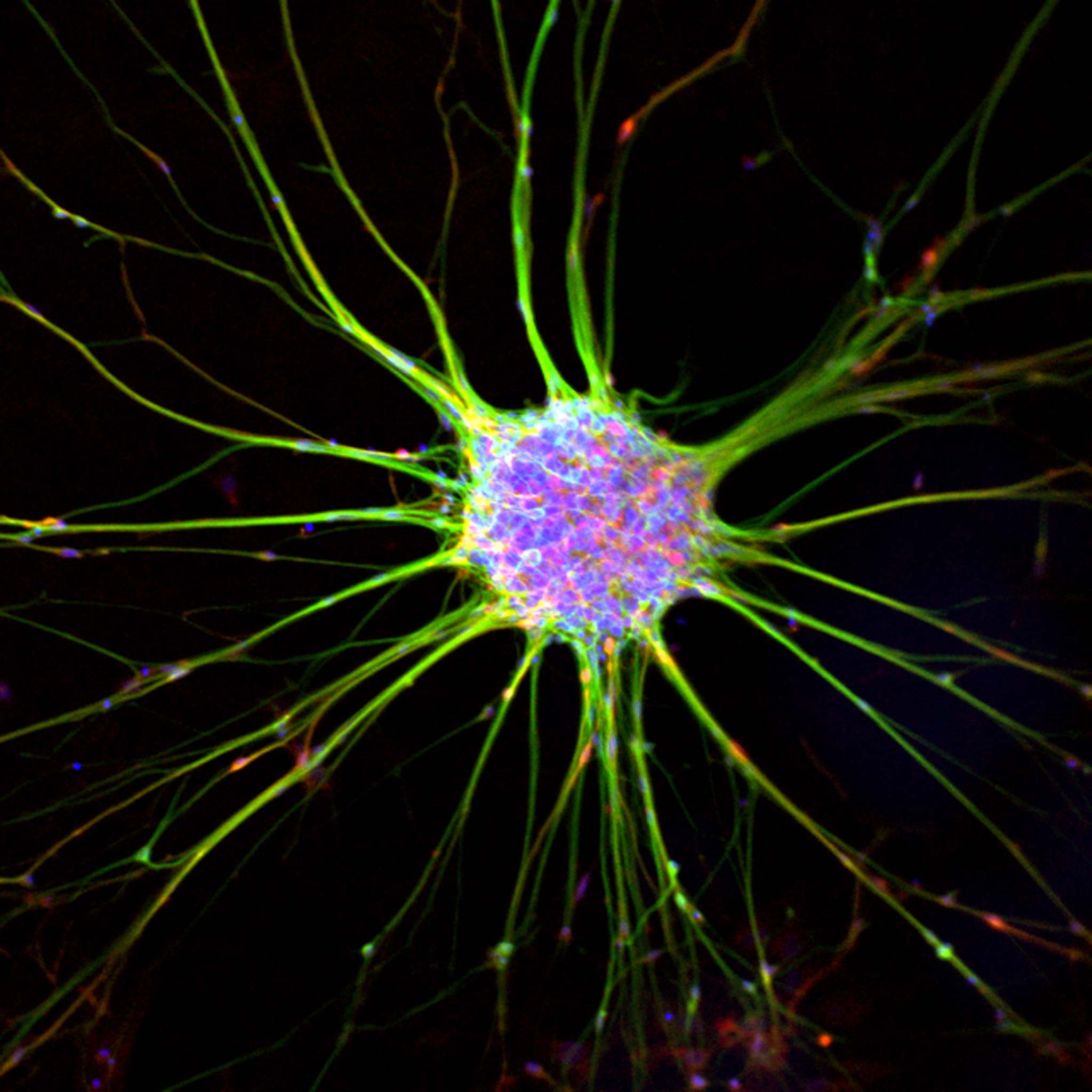 Cluster of neurons differentiated from embryonic stem cells | Nikon ...