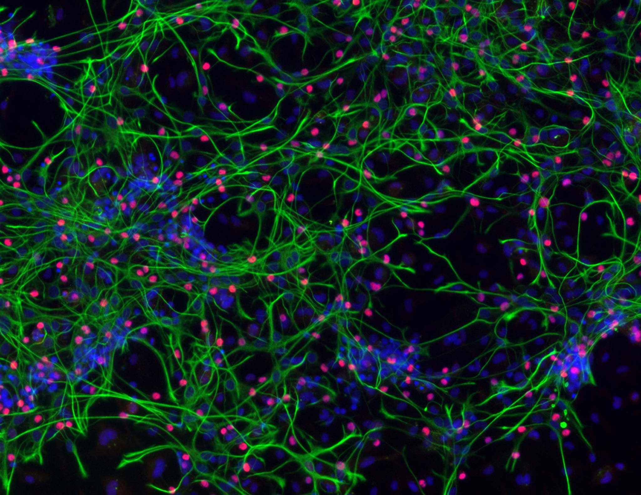 Rat embryo cerebral cortex, cultured as monolayer and stained for ...