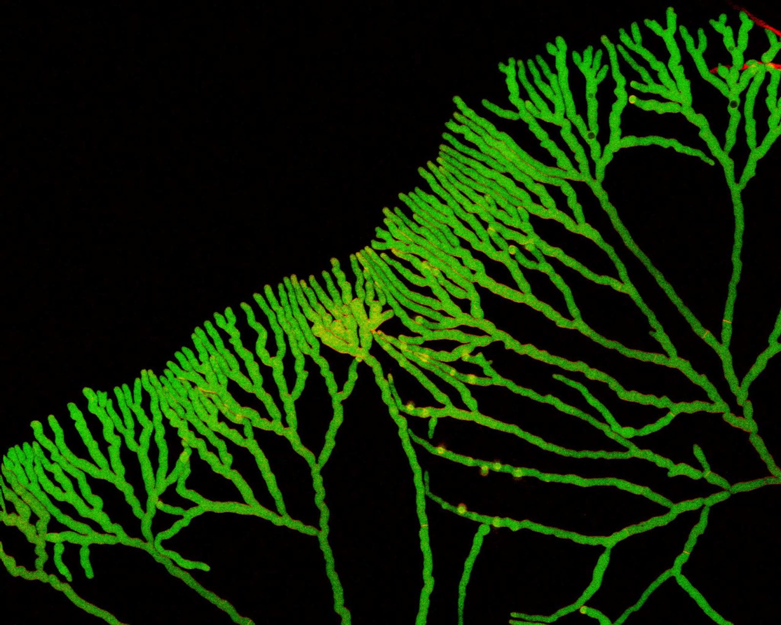 Hyperbranching of the fungus Neurospora crassa (bread mold) exposed to ...